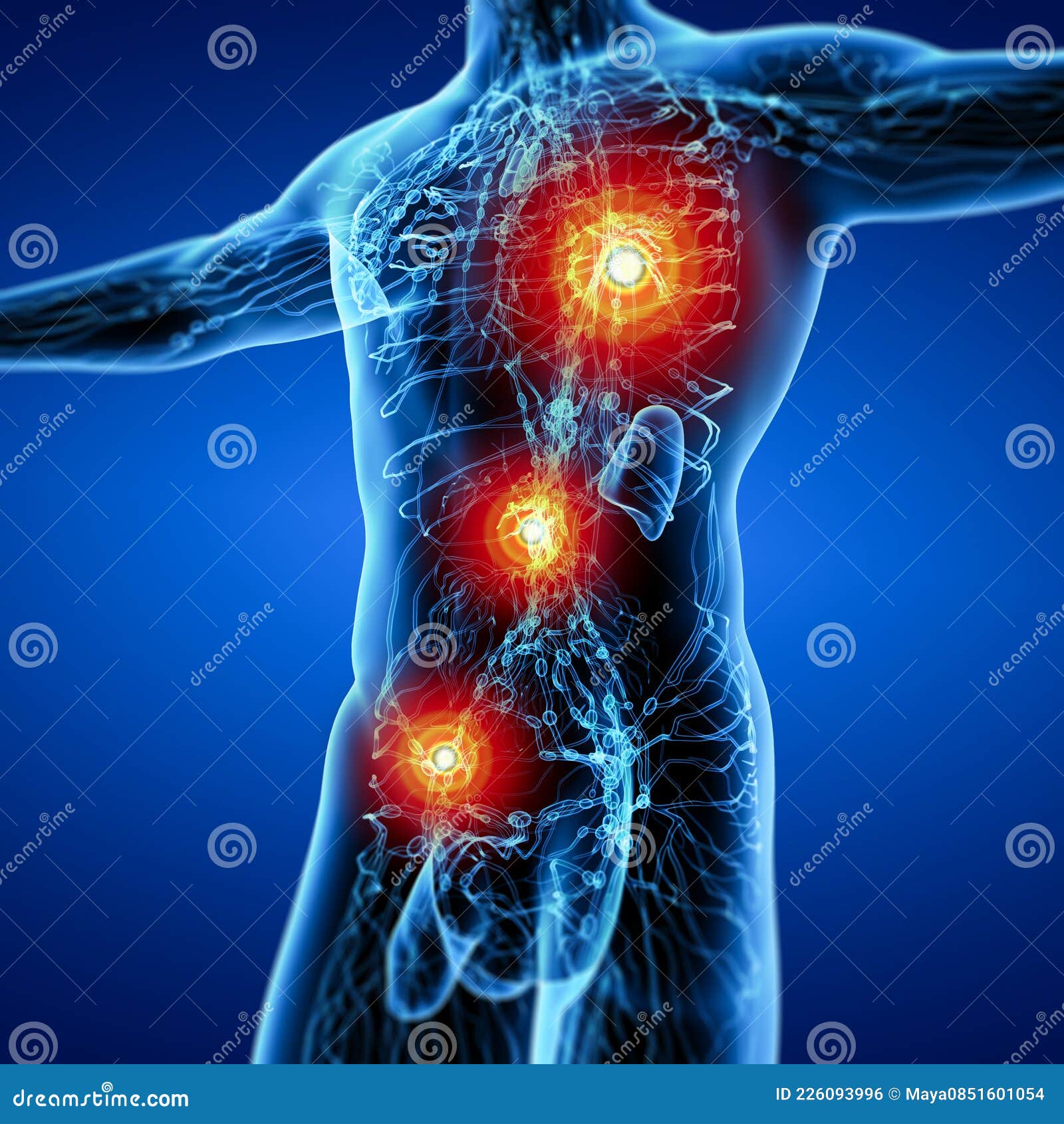 3D Rendering Illustration of Lymphatic System Stock Illustration ...