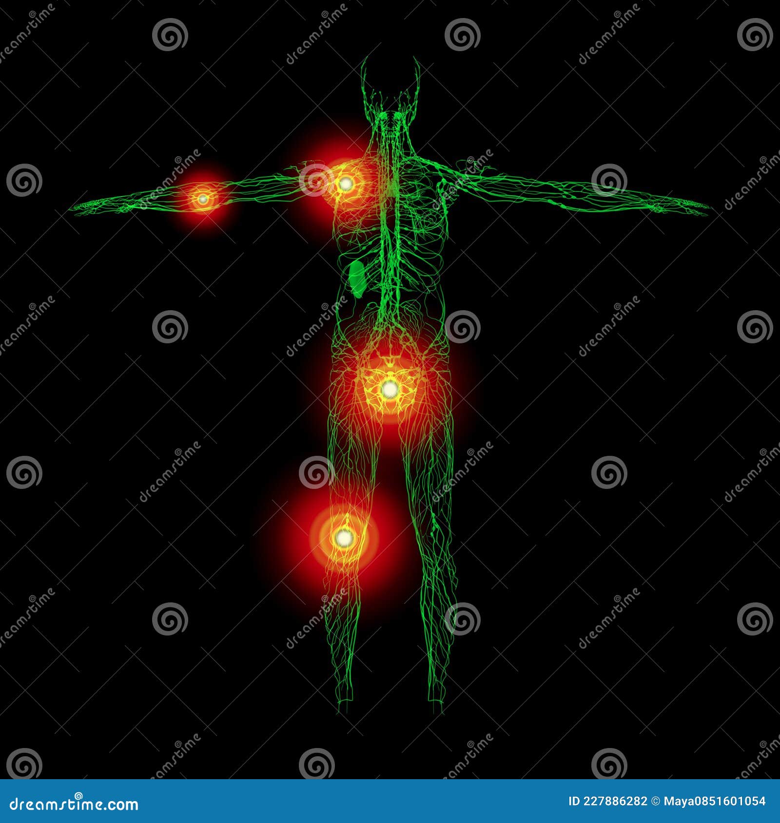 3D Rendering Illustration of Lymphatic System Stock Illustration ...