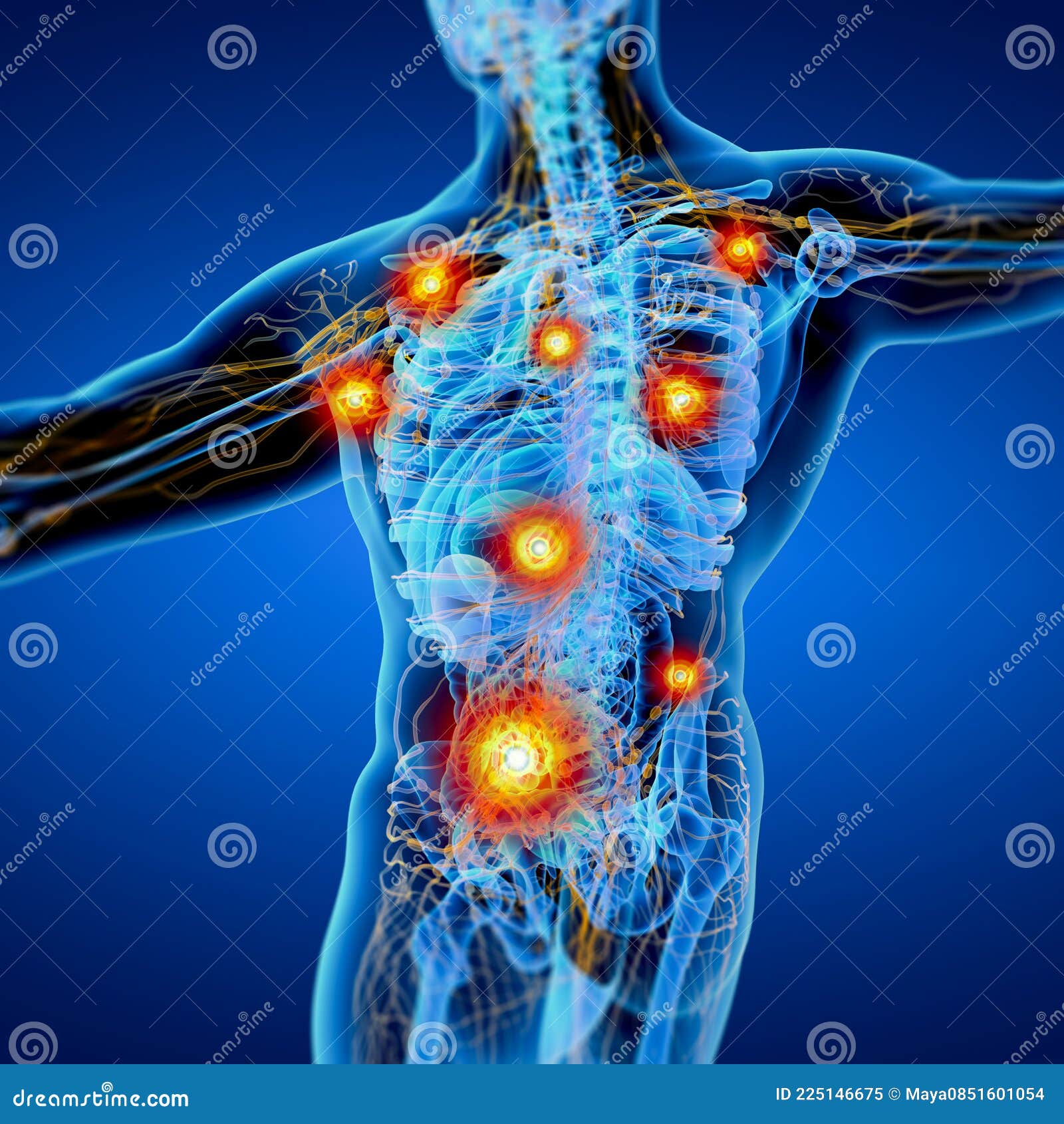 3D Rendering Illustration of Lymphatic System Stock Illustration ...