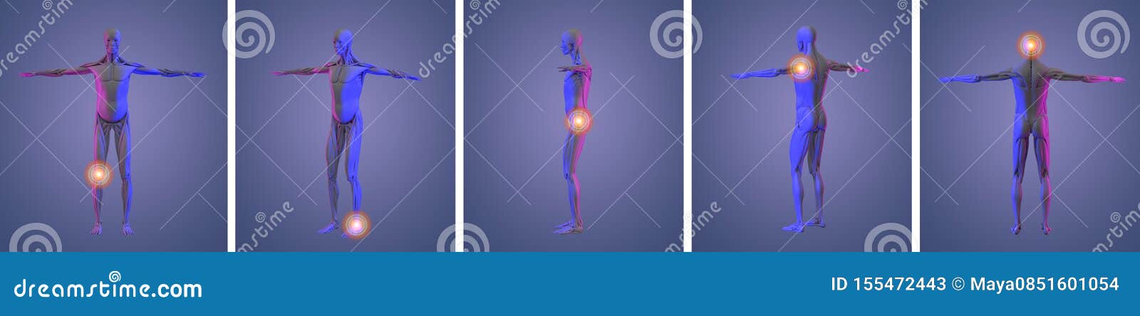 3d Rendering Illustration of Pain Muscle Stock Illustration ...