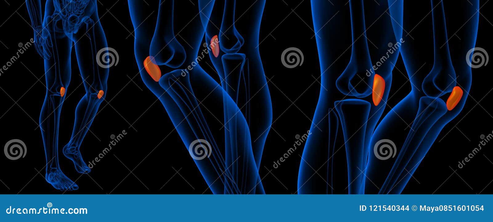 3d Rendering Illustration of Patella Stock Illustration - Illustration ...