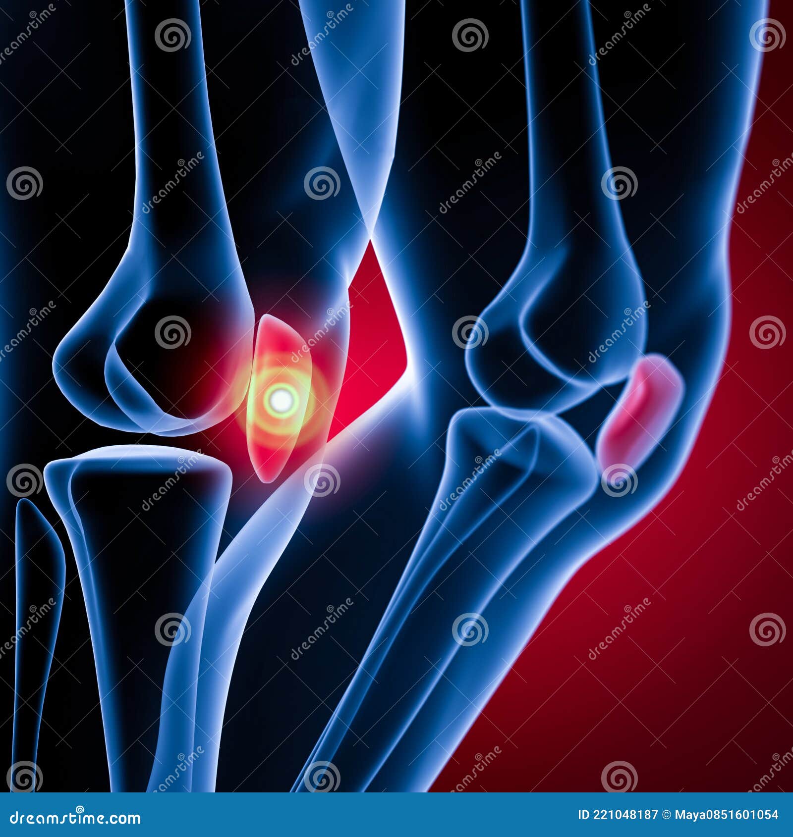 3D Rendering Illustration of Patella Stock Illustration - Illustration ...