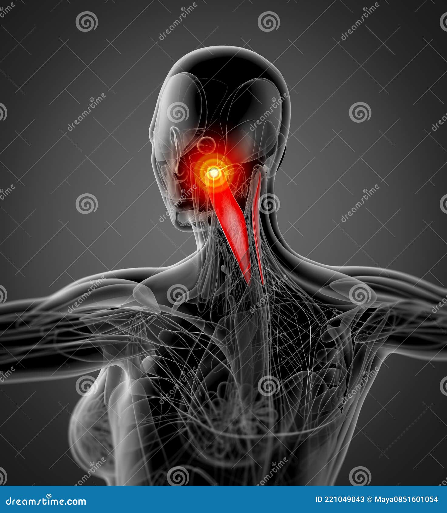 Medical Illustration of the Splenius Capitis Stock Illustration ...