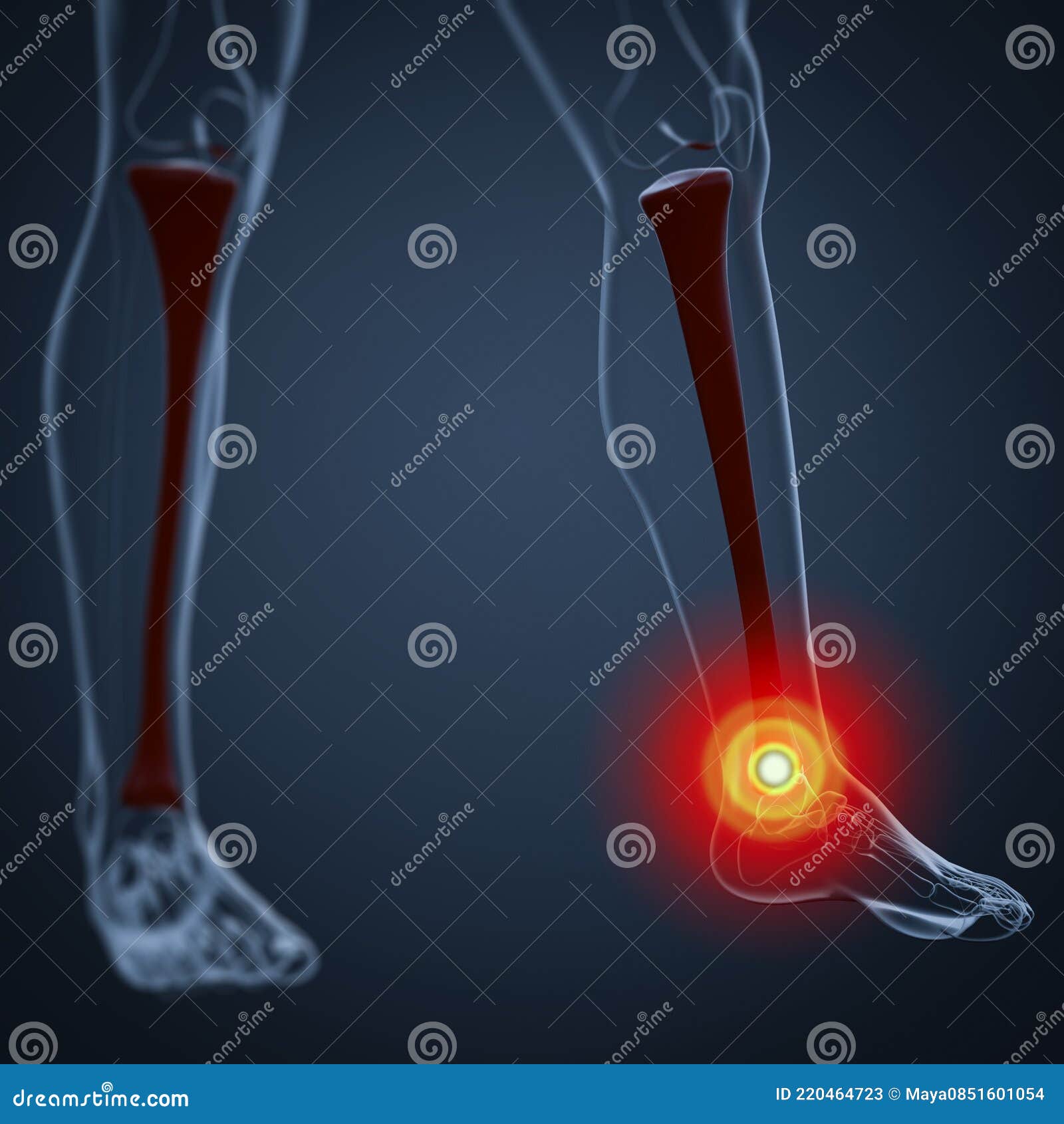 3D Rendering Illustration of Tibia Bone Stock Illustration ...