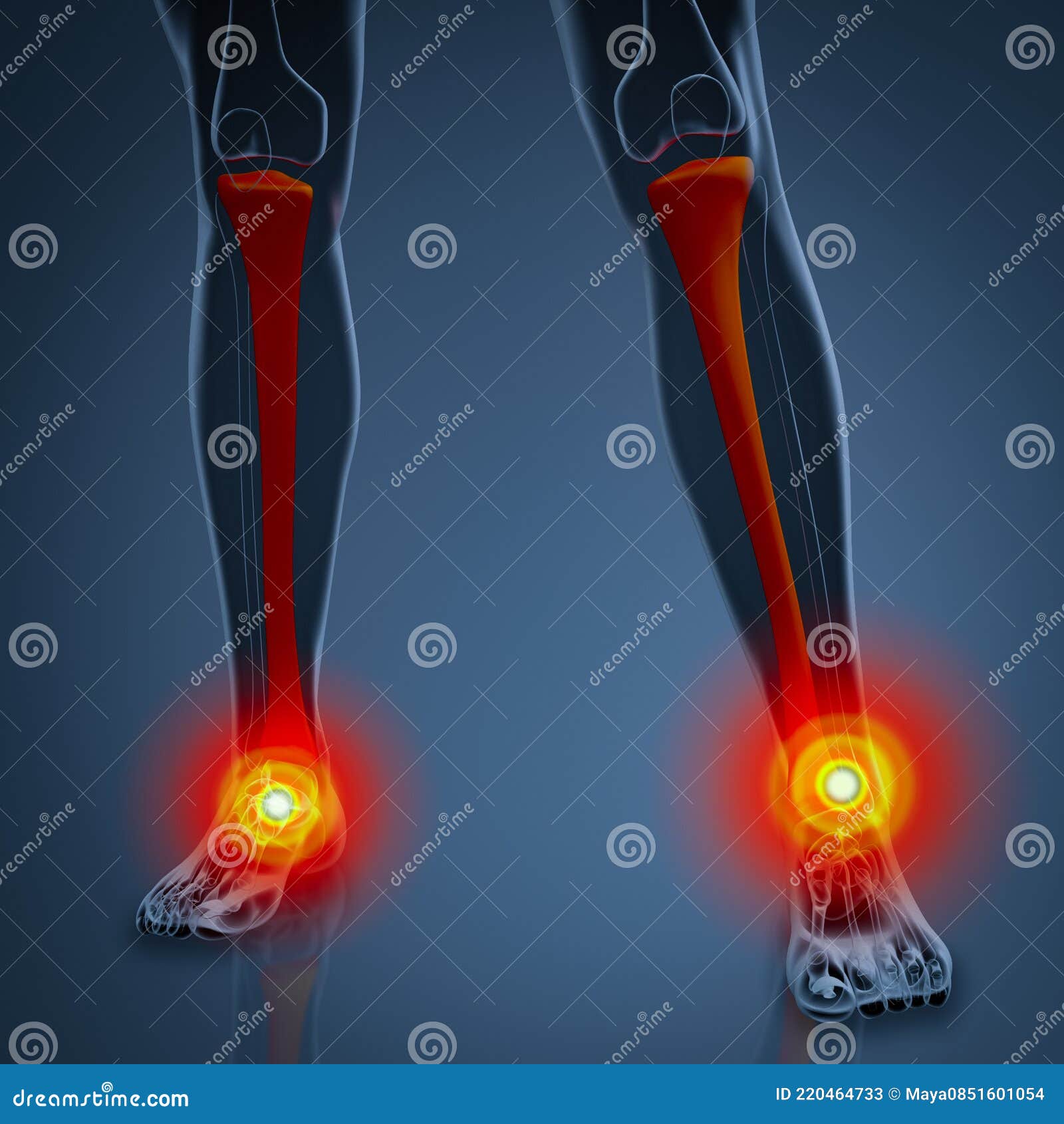 3D Rendering Illustration of Tibia Bone Stock Illustration ...