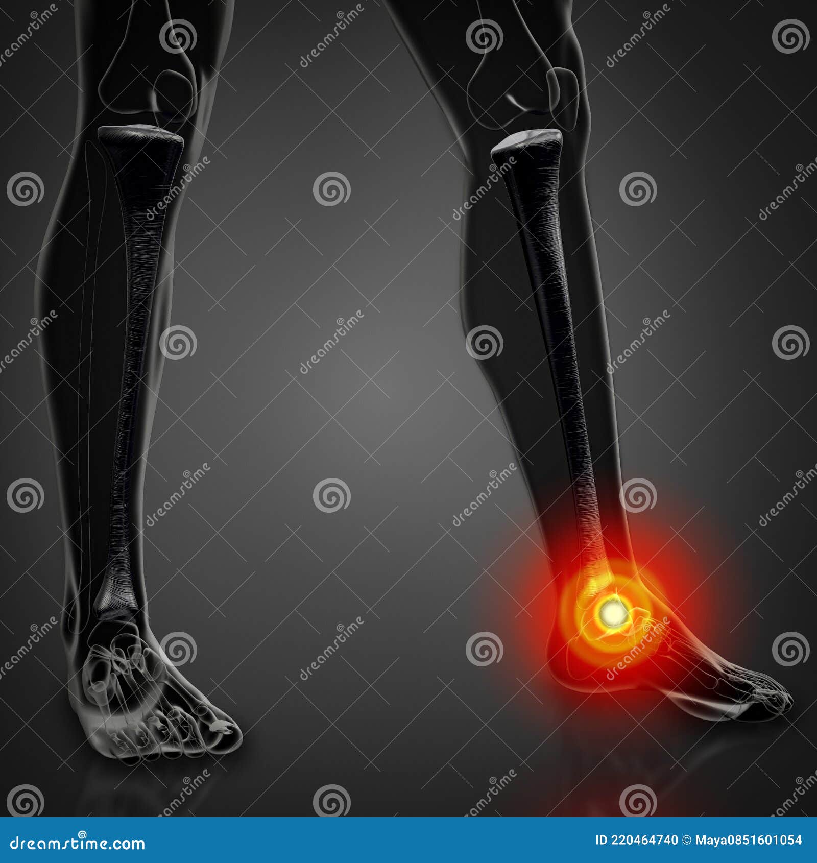 Tibia Bone Royalty-Free Cartoon | CartoonDealer.com #88889378