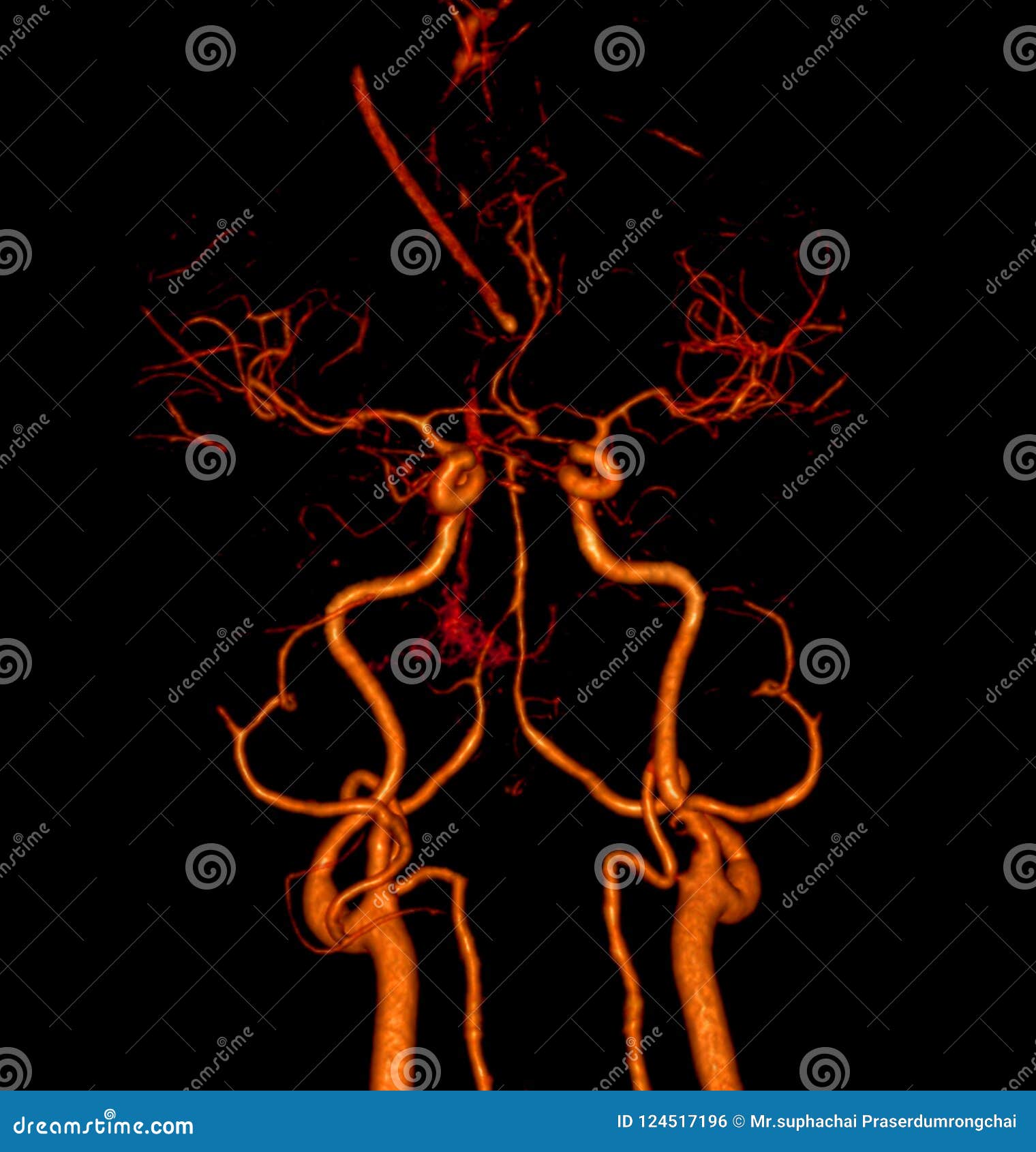 3D Rendering Image . Vessel of the Brain Stock Illustration ...
