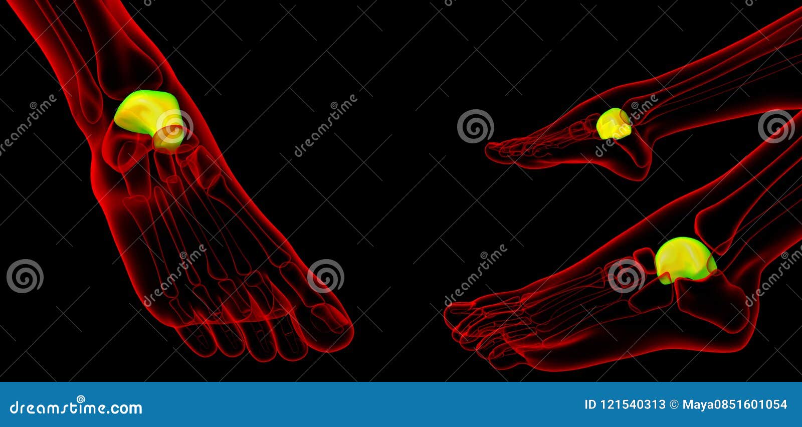 3d Rendering of the Malleolus Bone Stock Illustration - Illustration of ...
