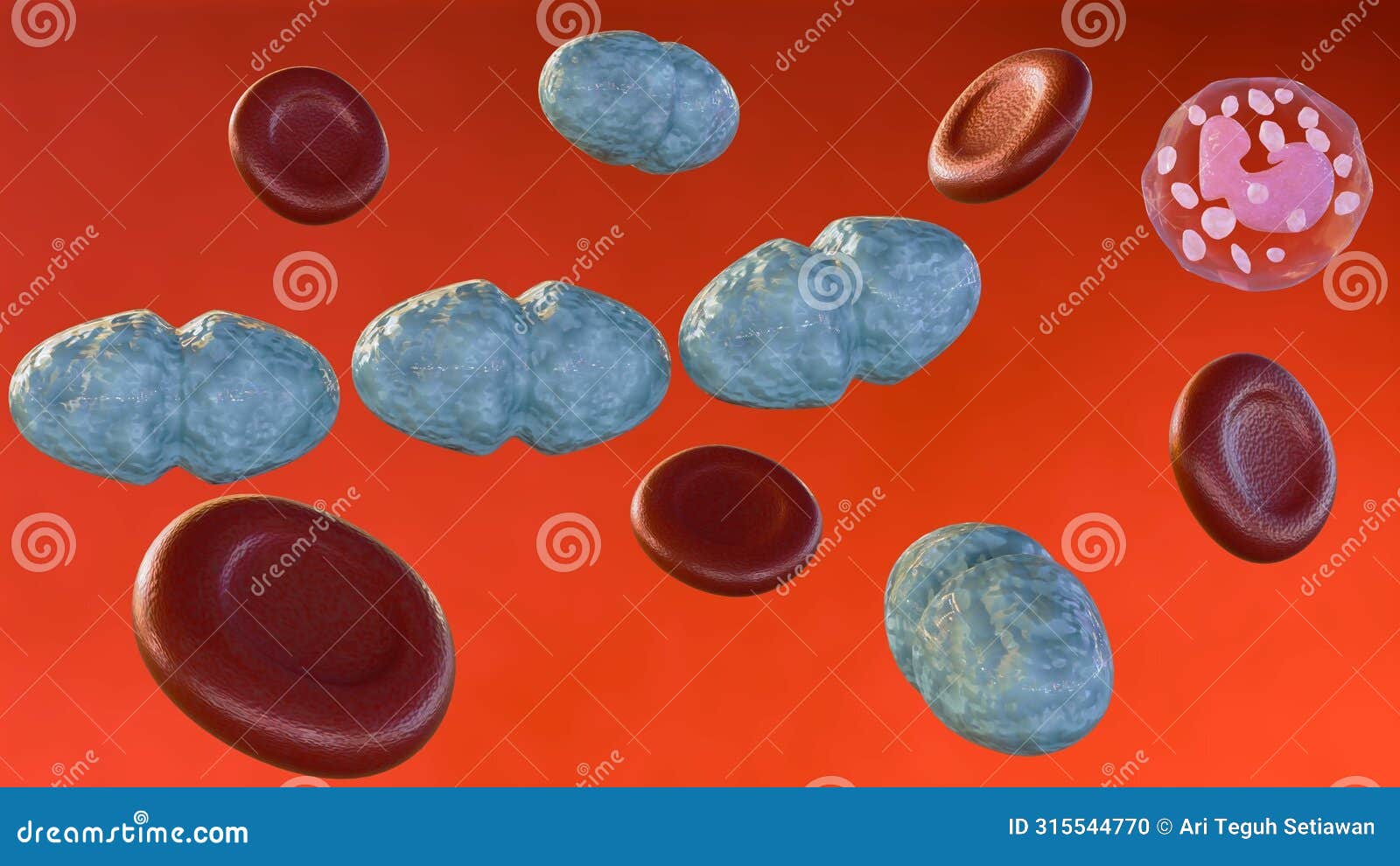3d Rendering of Septicemia, or Sepsis by Streptococcus Pyogenes Stock ...
