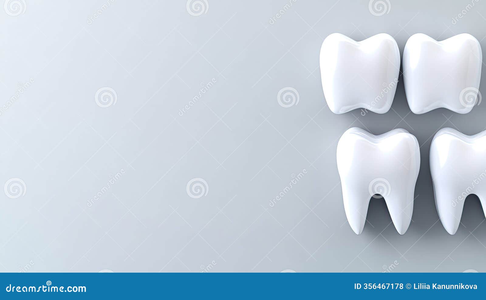 This 3D Rendering Shows Three Teeth on a Long Dental Screw, Emphasizing ...
