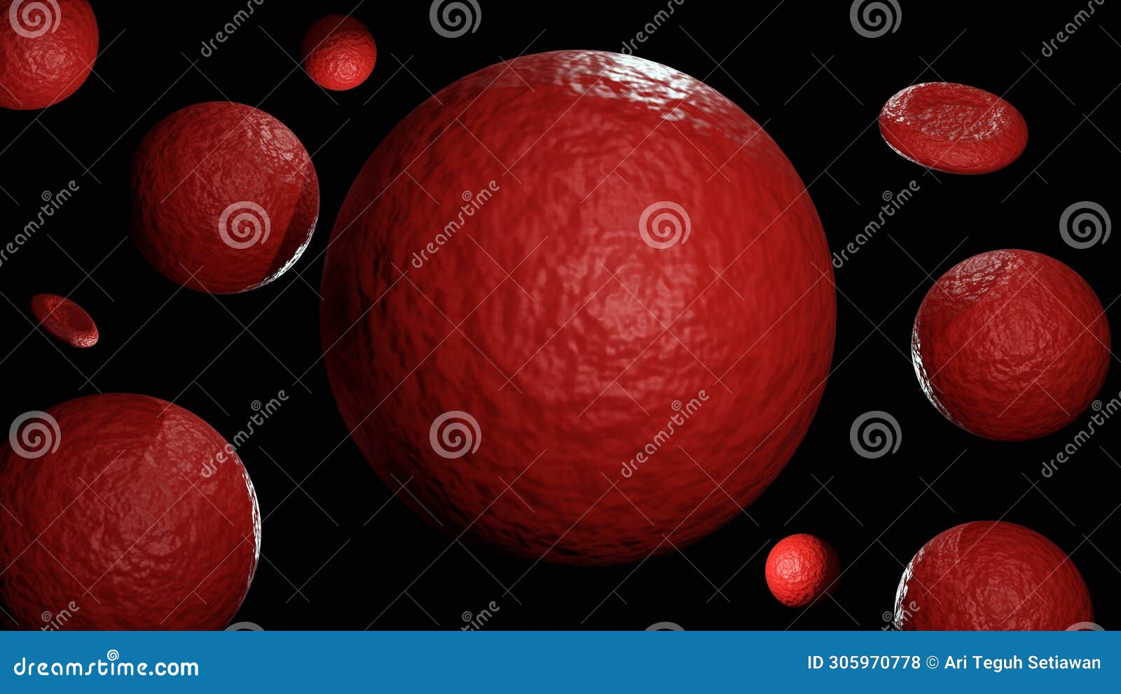 A Red Blood Cell (RBC) that is Spherical in Shape or Spherocyte Stock ...