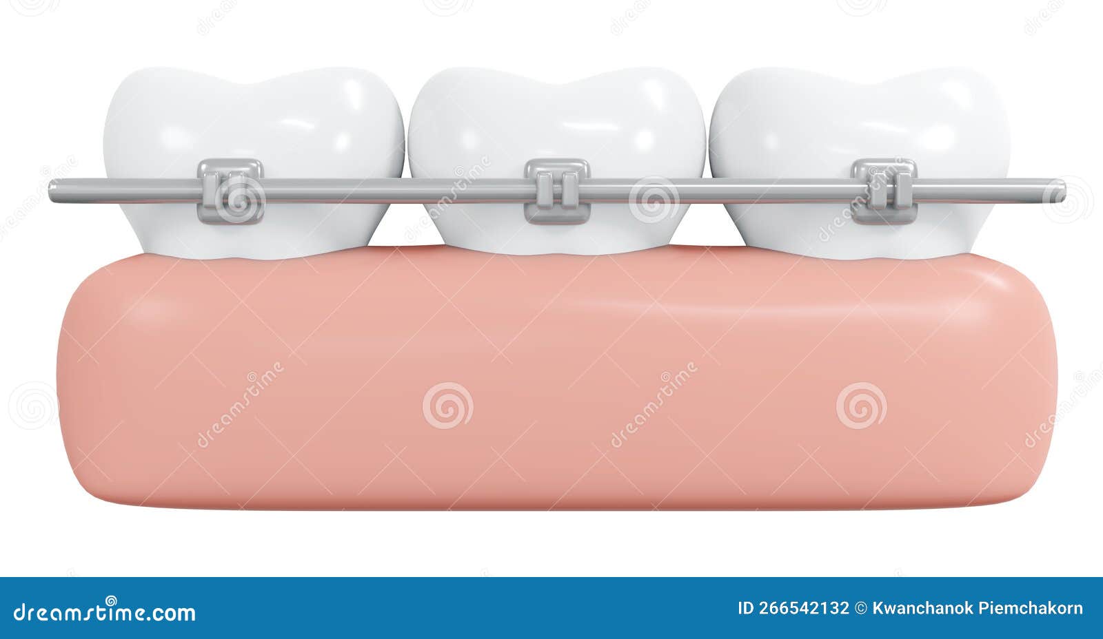 3D Rendering Teeth Braces Icon Cartoon Style Isolated on White. Stock ...