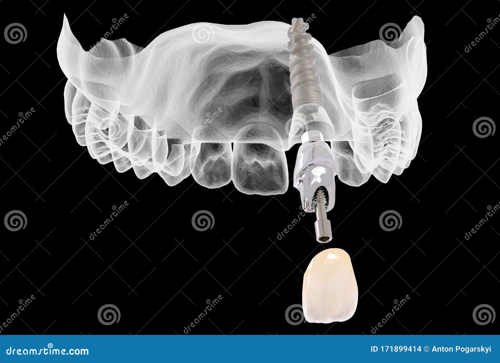 3D rendering teeth stock illustration. Illustration of 3dmodel - 171899414