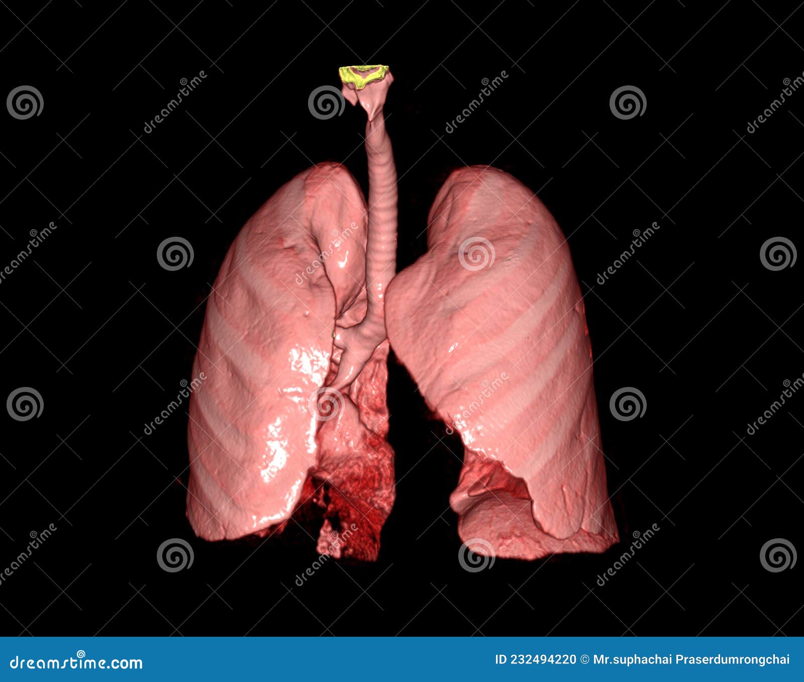 3d Renderings of Human Lung Showing Respiratory System Editorial Image ...