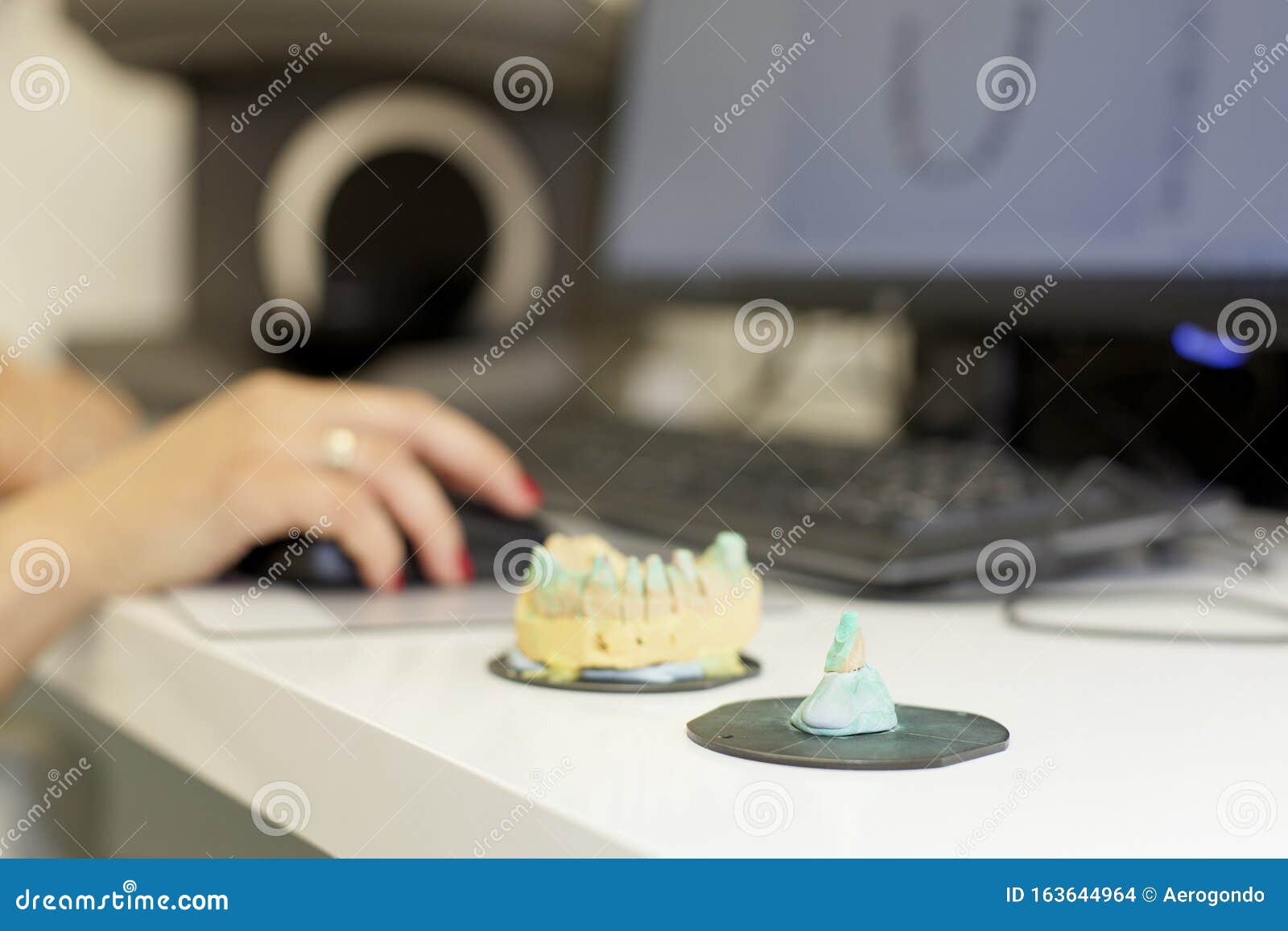 3d Scanning a Dental Prosthetic Tooth Stock Photo - Image of gypsum ...