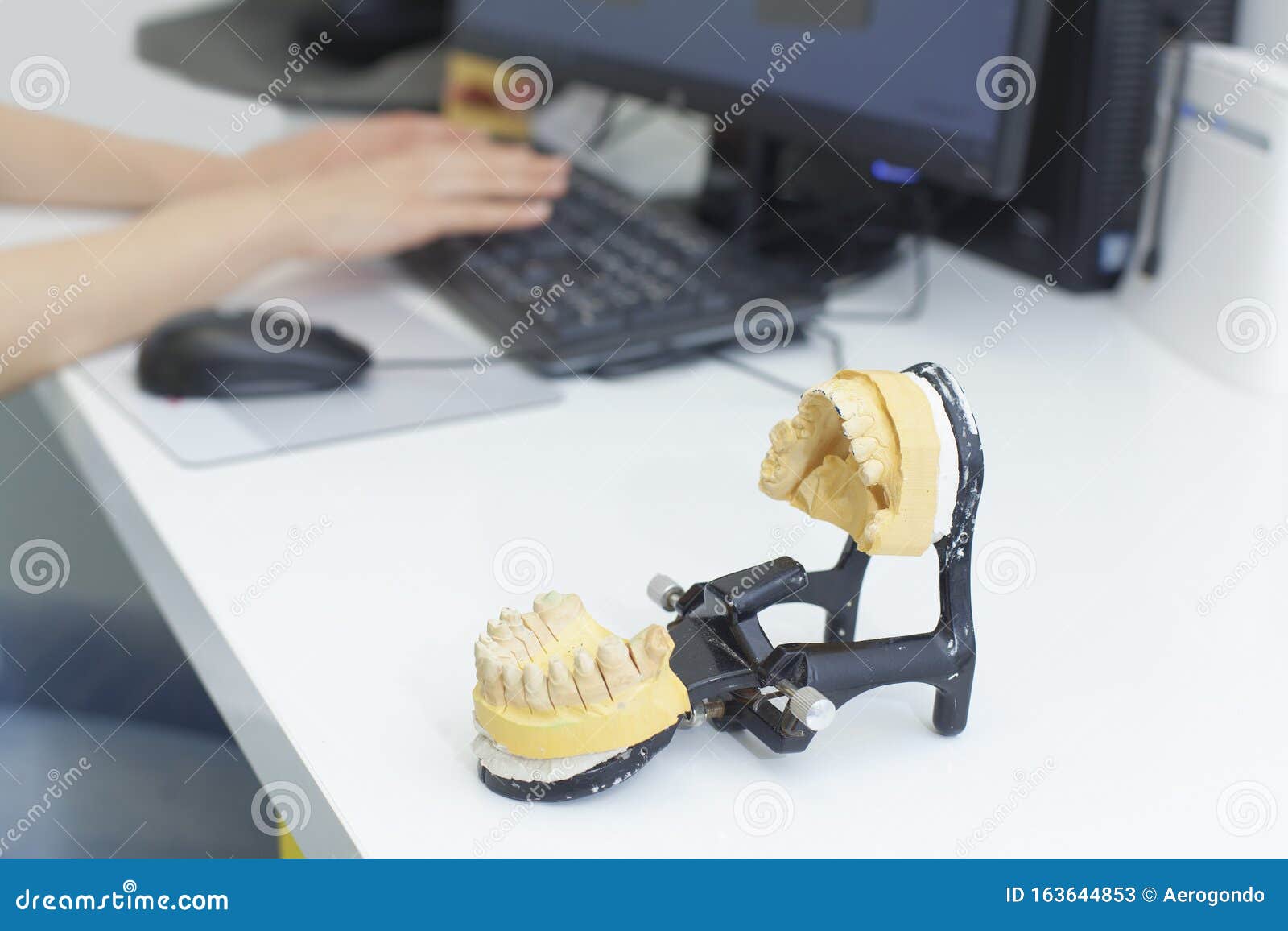 3d Scanning and Printing of Dental Prosthesis Stock Image - Image of ...