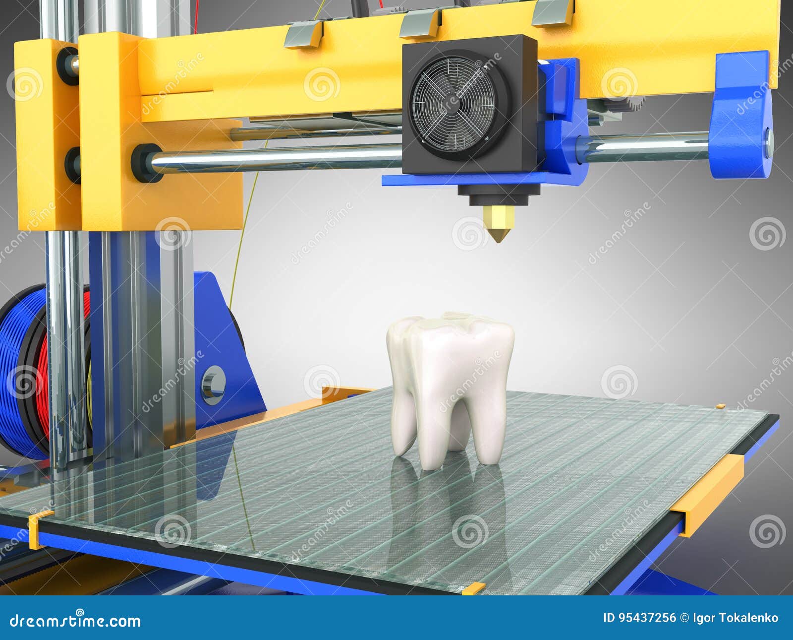 3d Tooth Printer 3d Render on Gray Background Stock Illustration ...