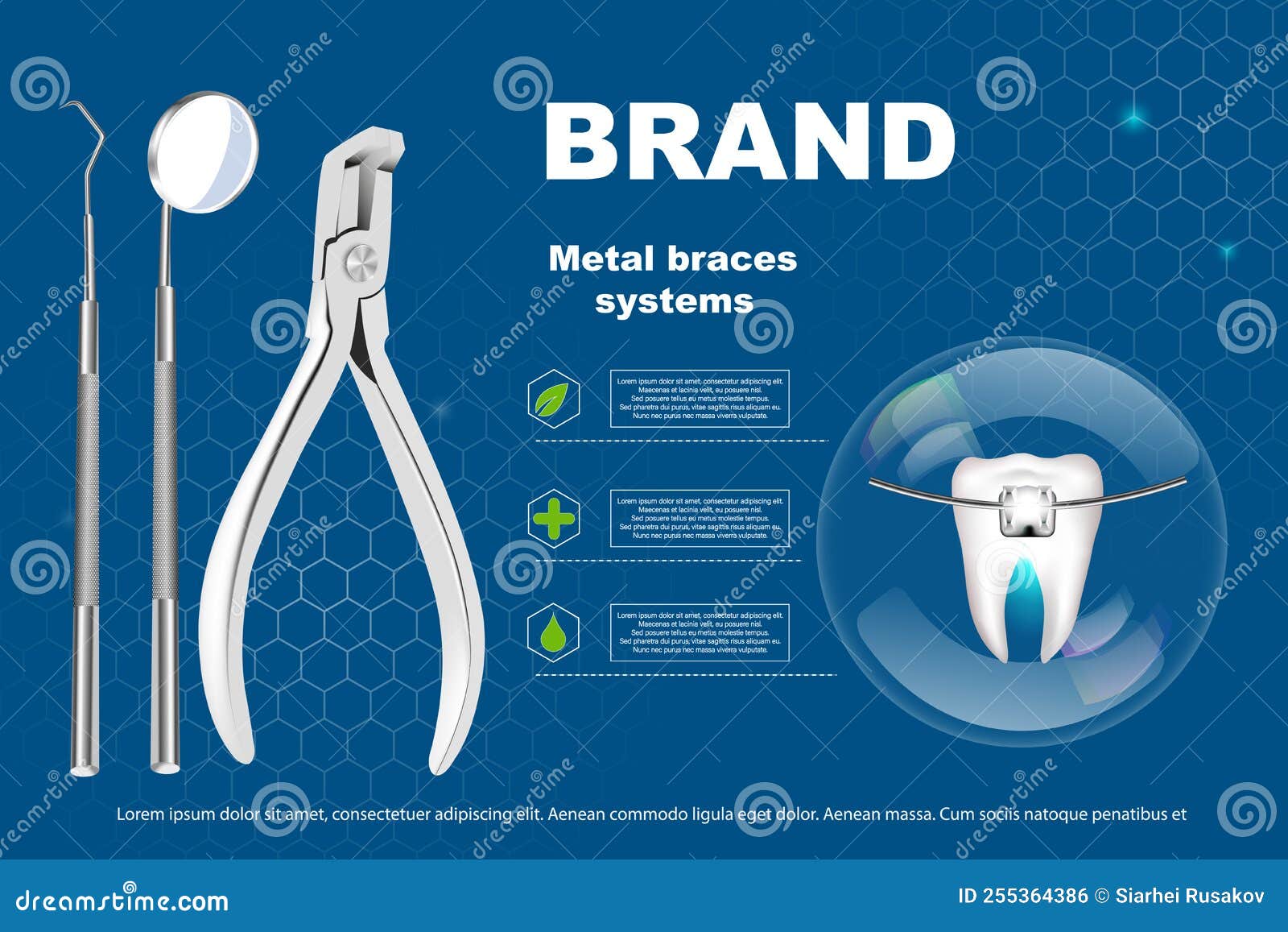 3d Vector Illustration, Realistic Teeth With Braces. Alignment Of The ...