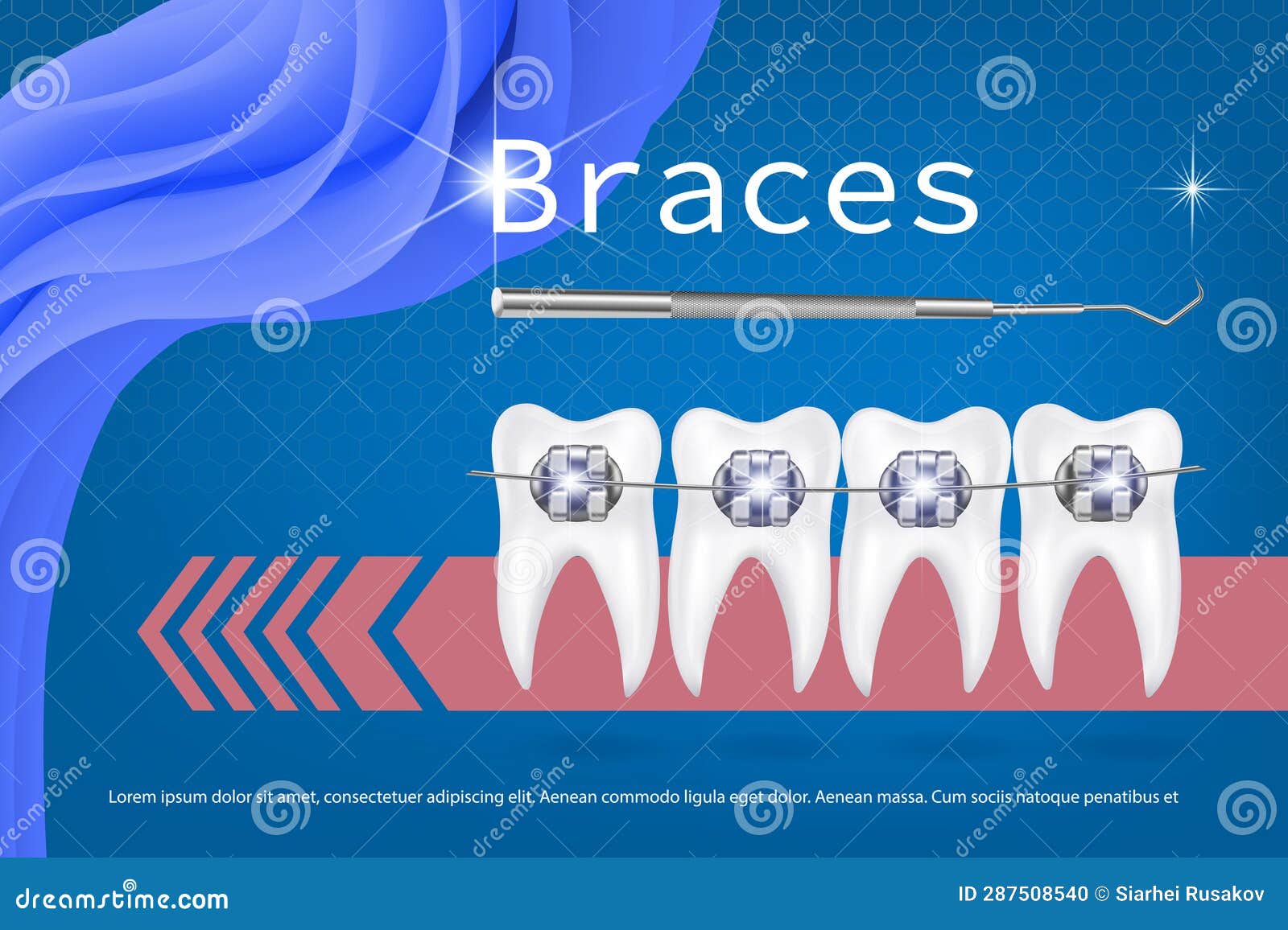 3d Vector Illustration, Realistic Teeth with Braces Upper and Lower Jaw ...