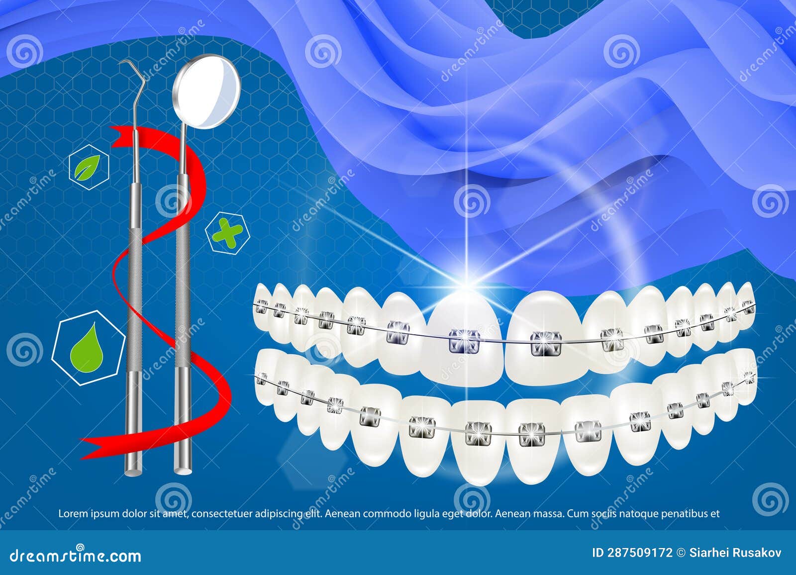 3d Vector Illustration, Realistic Teeth with Braces Upper and Lower Jaw ...