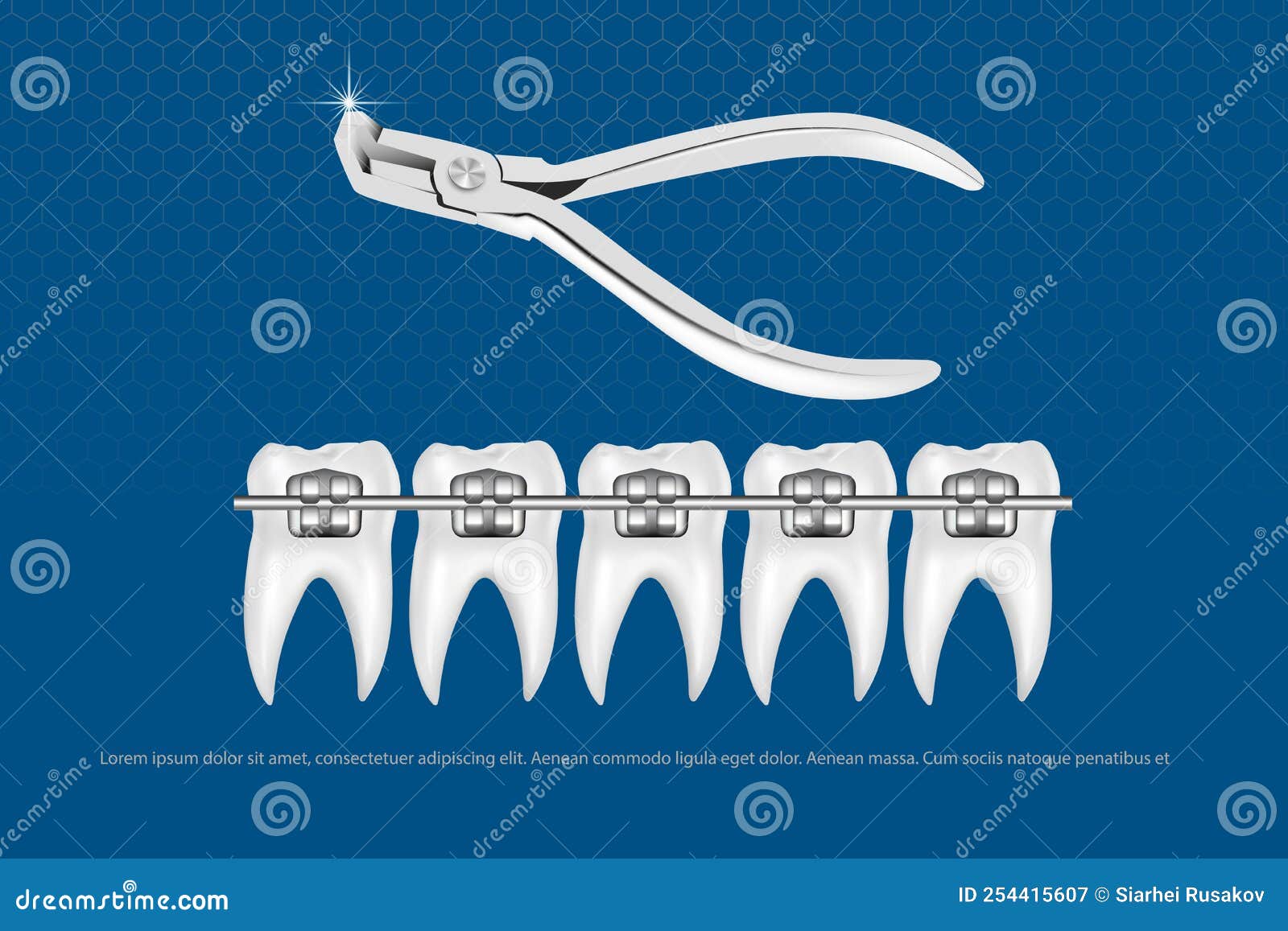 3d Vector Illustration, Realistic Teeth with Braces Upper and Lower Jaw ...