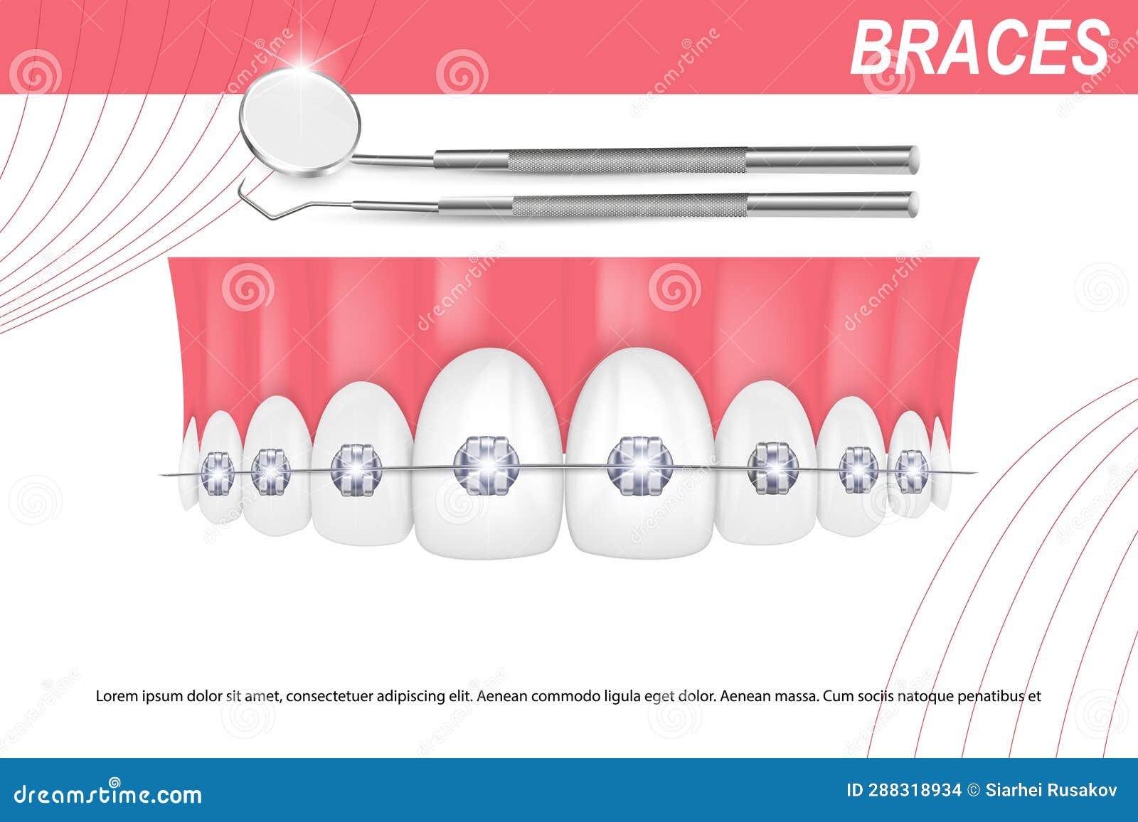 3d Vector Illustration, Realistic Teeth with Braces Upper and Lower Jaw ...