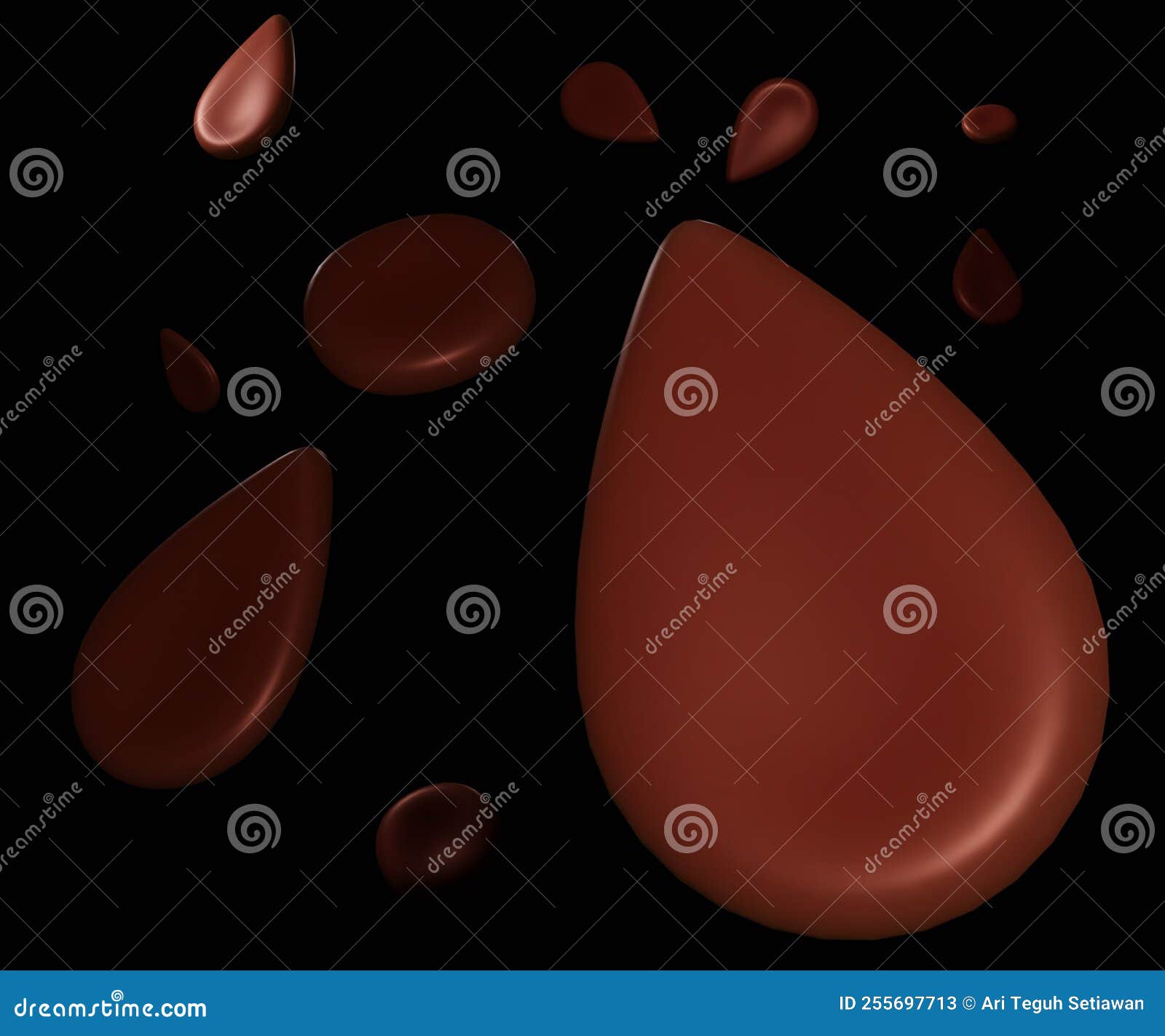 A Dacrocyte or Dacryocyte is a Type of Poikilocyte that is Shaped Like ...