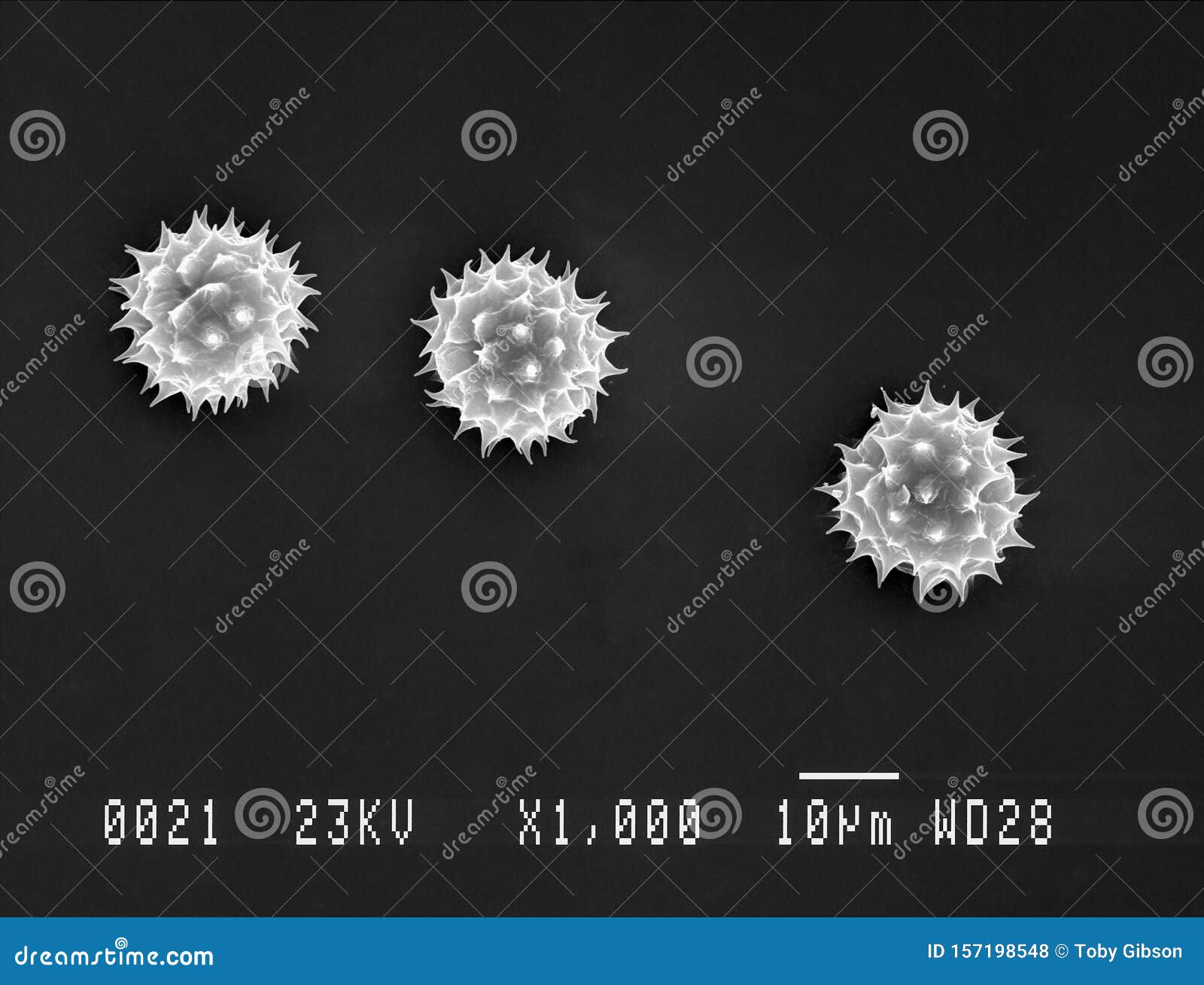 Daisy Pollen Under Electron Microscope Stock Photo - Image of medicine ...