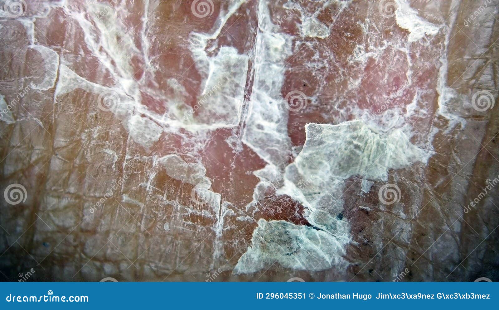 Microscopic Human Skin