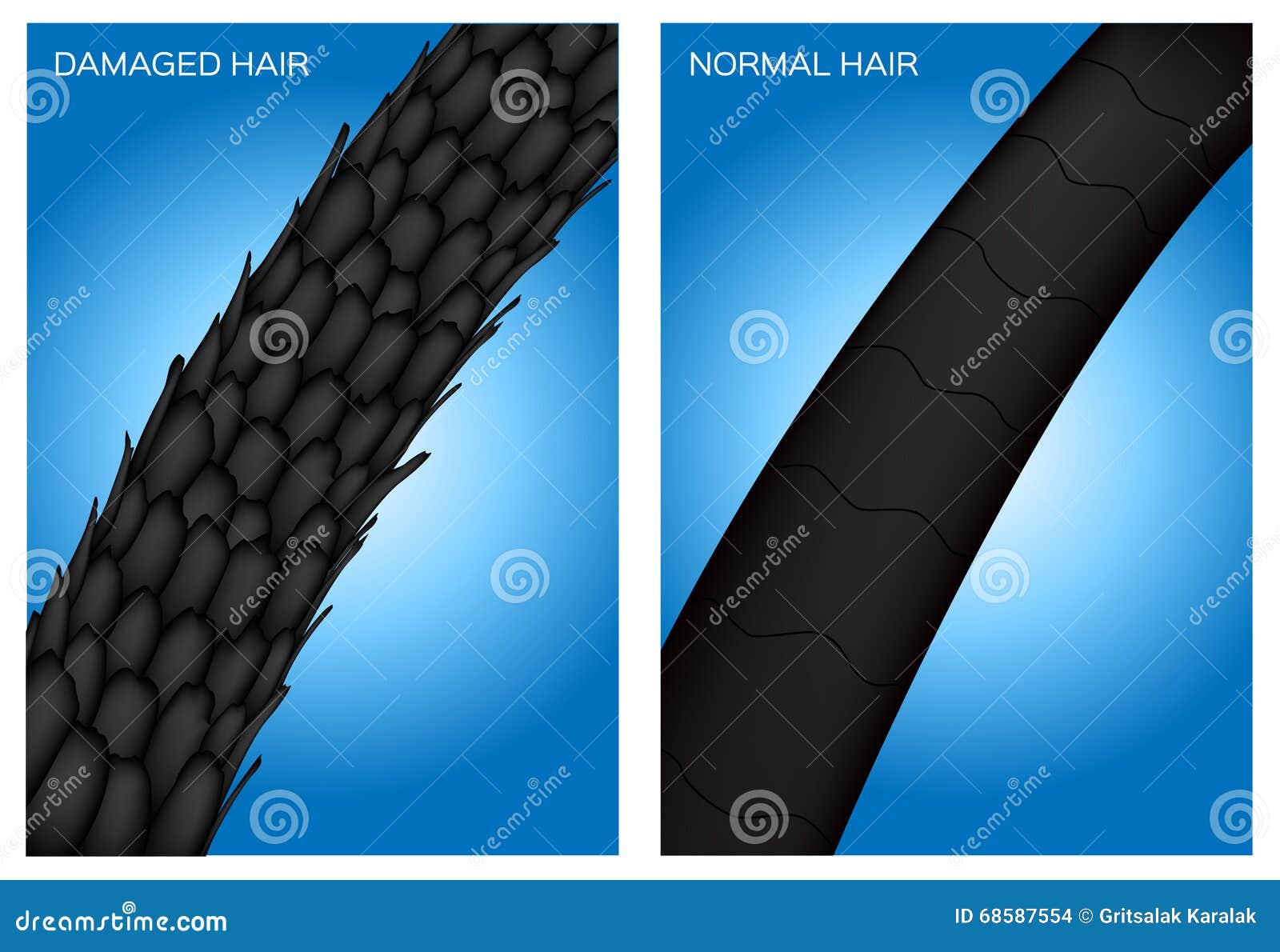 3d Damaged Hair, Dry Scalp Skin With Follicles For Micro Diagnosis And ...