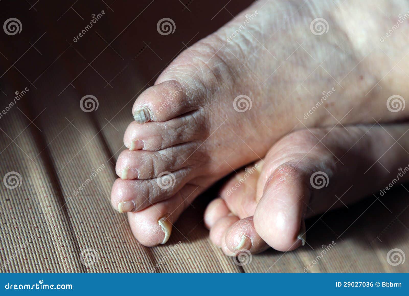 Crusty Feet Photos - Free & Royalty-Free Stock Photos from Dreamstime