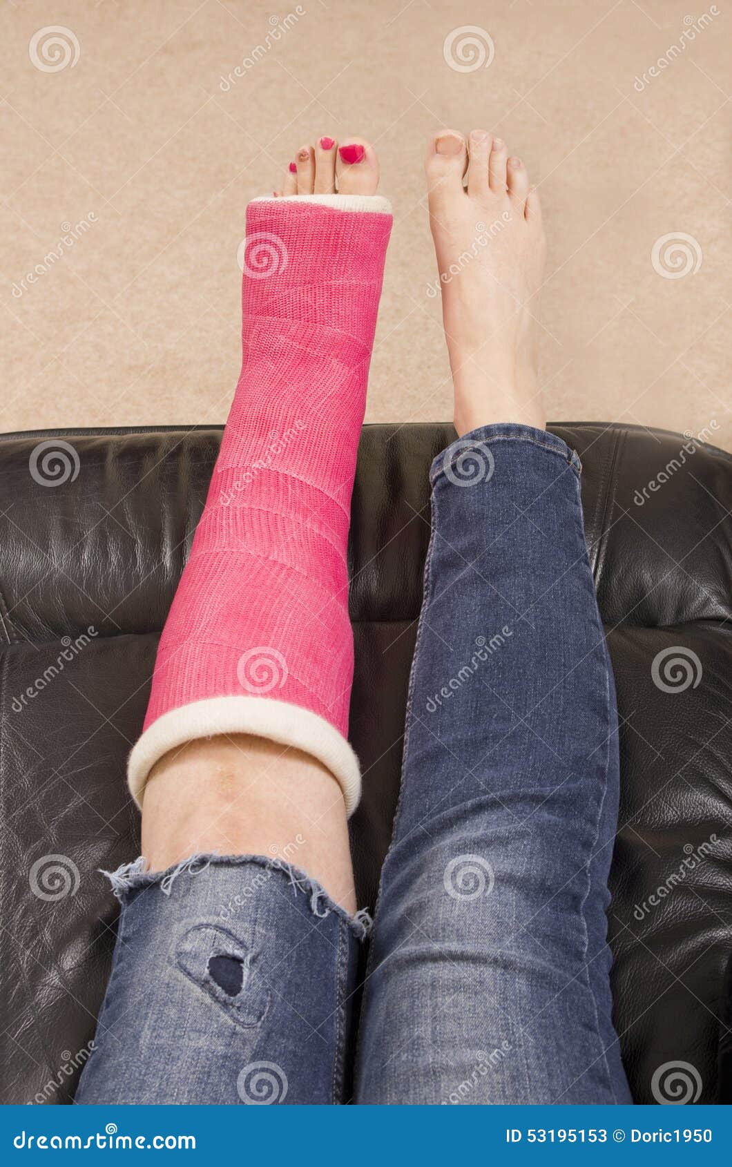 Dame met Gebroken Been stock afbeelding. Image of foto - 53195153