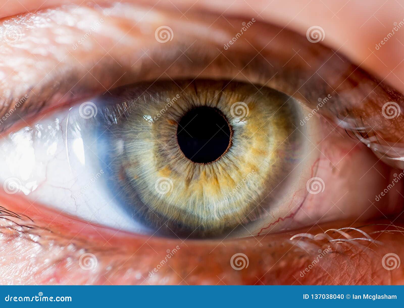 Close Up Eye. Close Up Iris. Very Close Macro Shot of an Eyeball. Pale ...