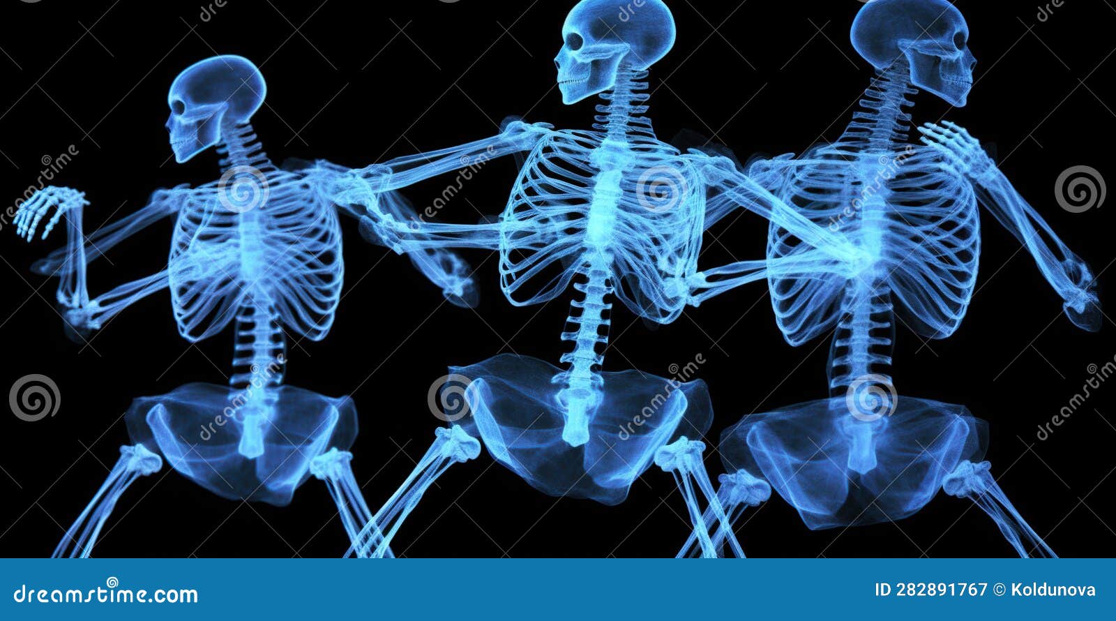 Dancing X-rays, Concept of Radiography Art, Created with Generative AI ...