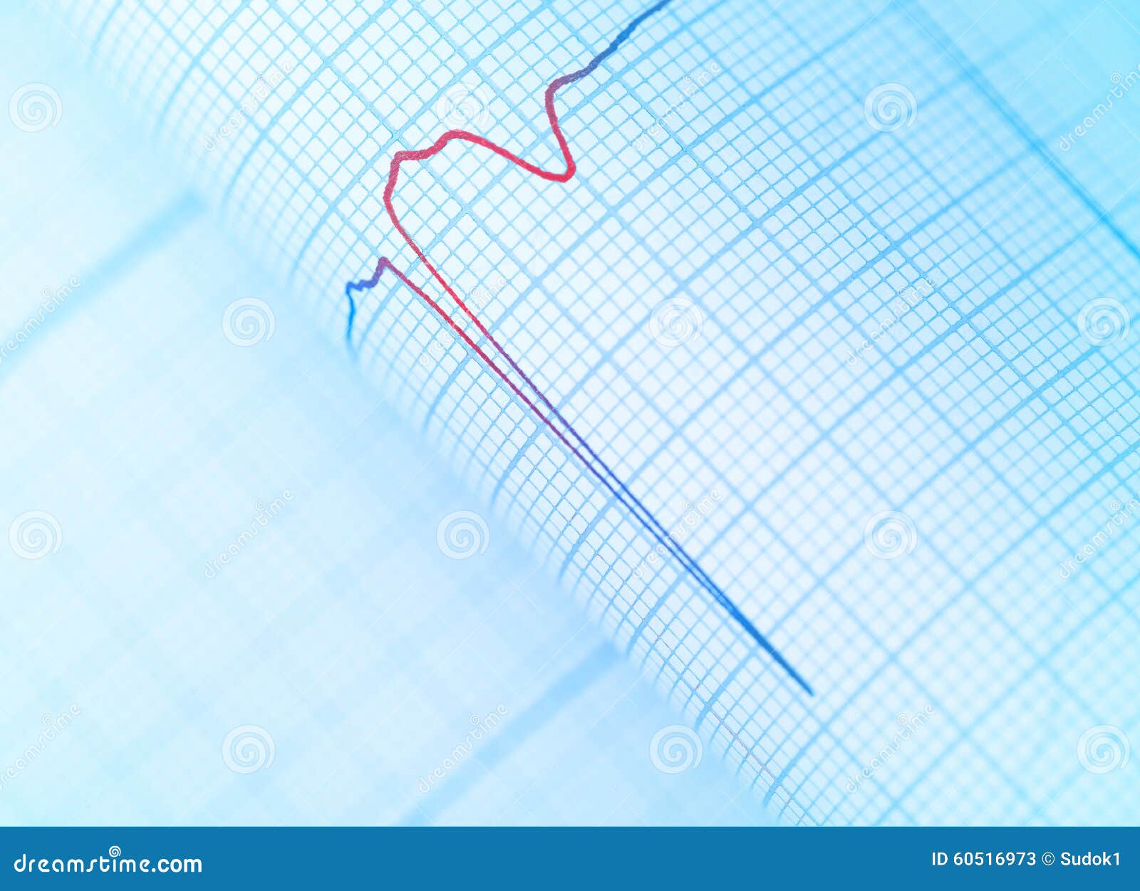 Danger Sign on the Patient S ECG Stock Image - Image of heartbeat ...