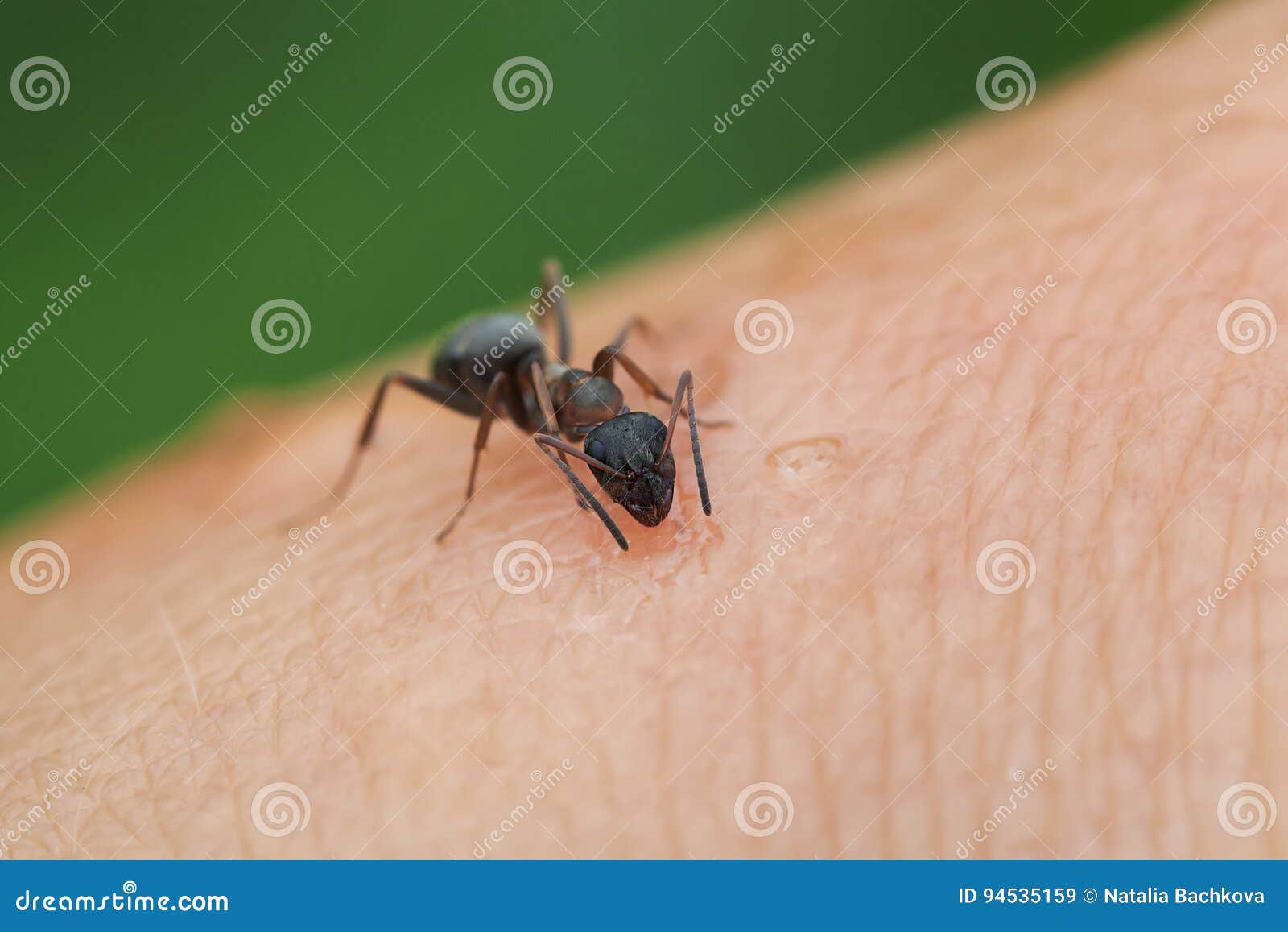 Dangerous Insect Ant Crawling on Human Skin Stock Image - Image of ...