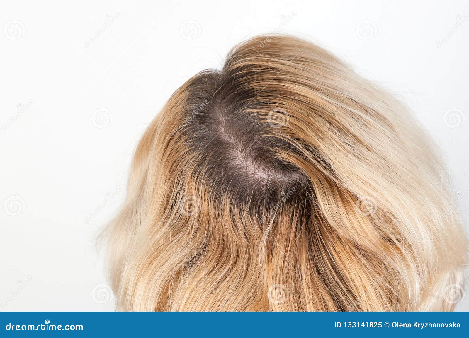 Dark Roots of Hair, Overgrown Hair Stock Image - Image of regrown ...