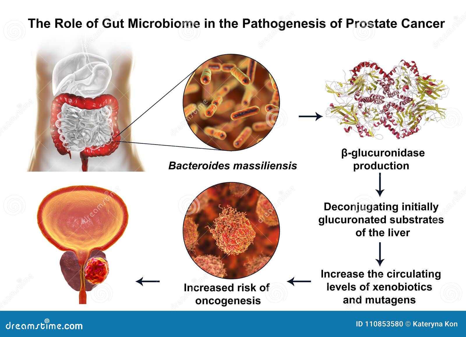 Darm Microbiome Und Prostatakrebs Stock Abbildung - Illustration von ...