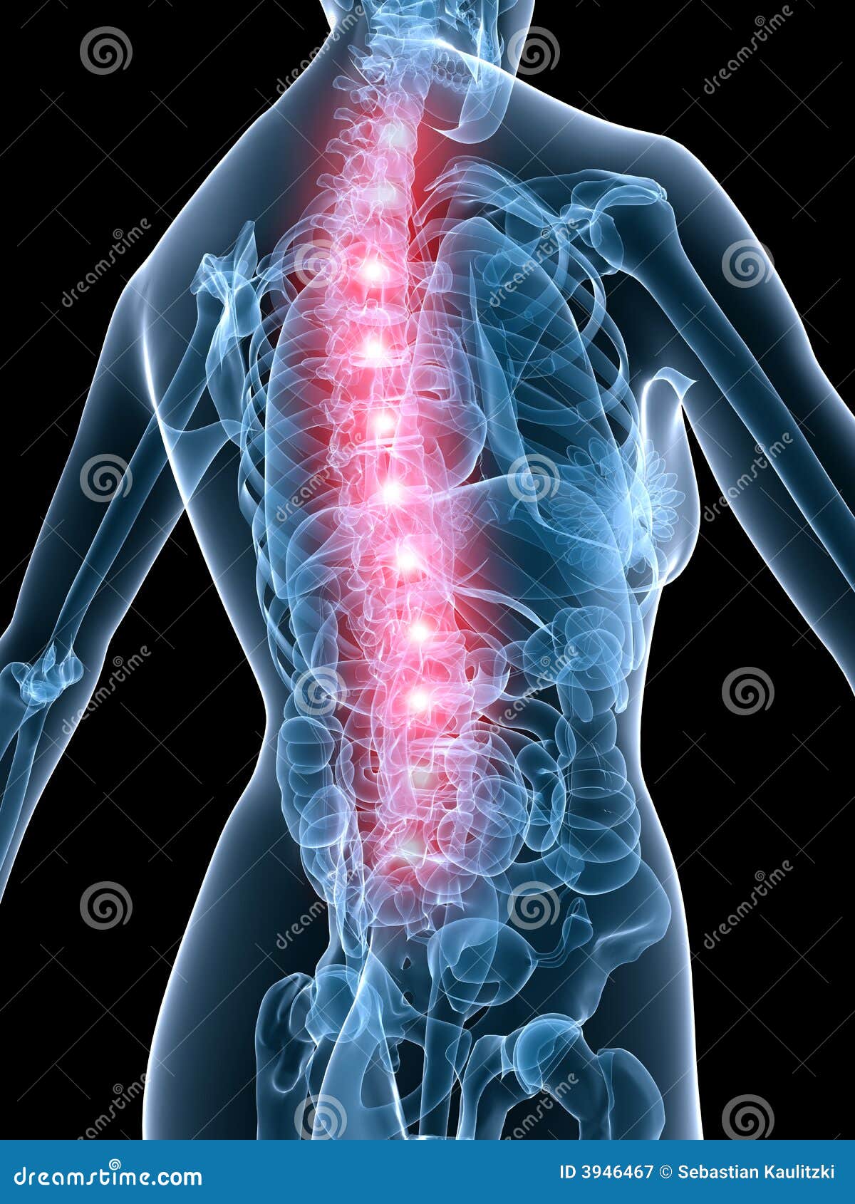 De Anatomie-rugpijn Van De Röntgenstraal Stock Illustratie ...