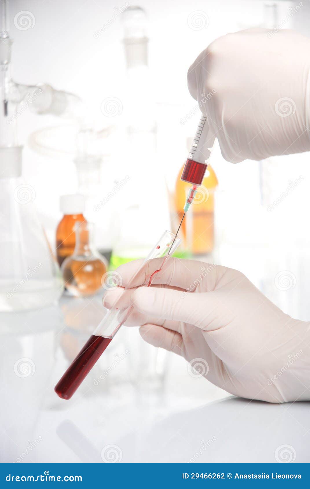 De Arts Dient Handschoen Met Bloed in Stock Foto - Image of biochemie ...