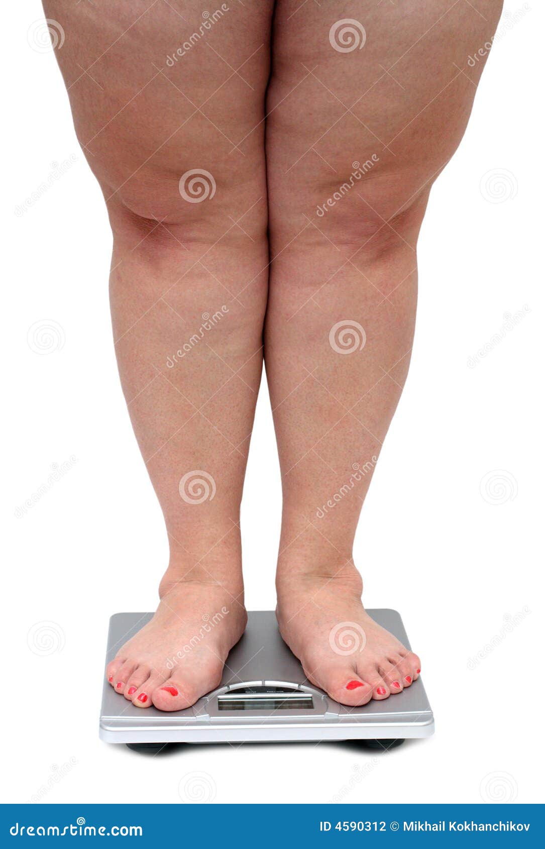 De Benen Van Vrouwen Met Overgewicht Stock Foto - Image of wijfjes ...