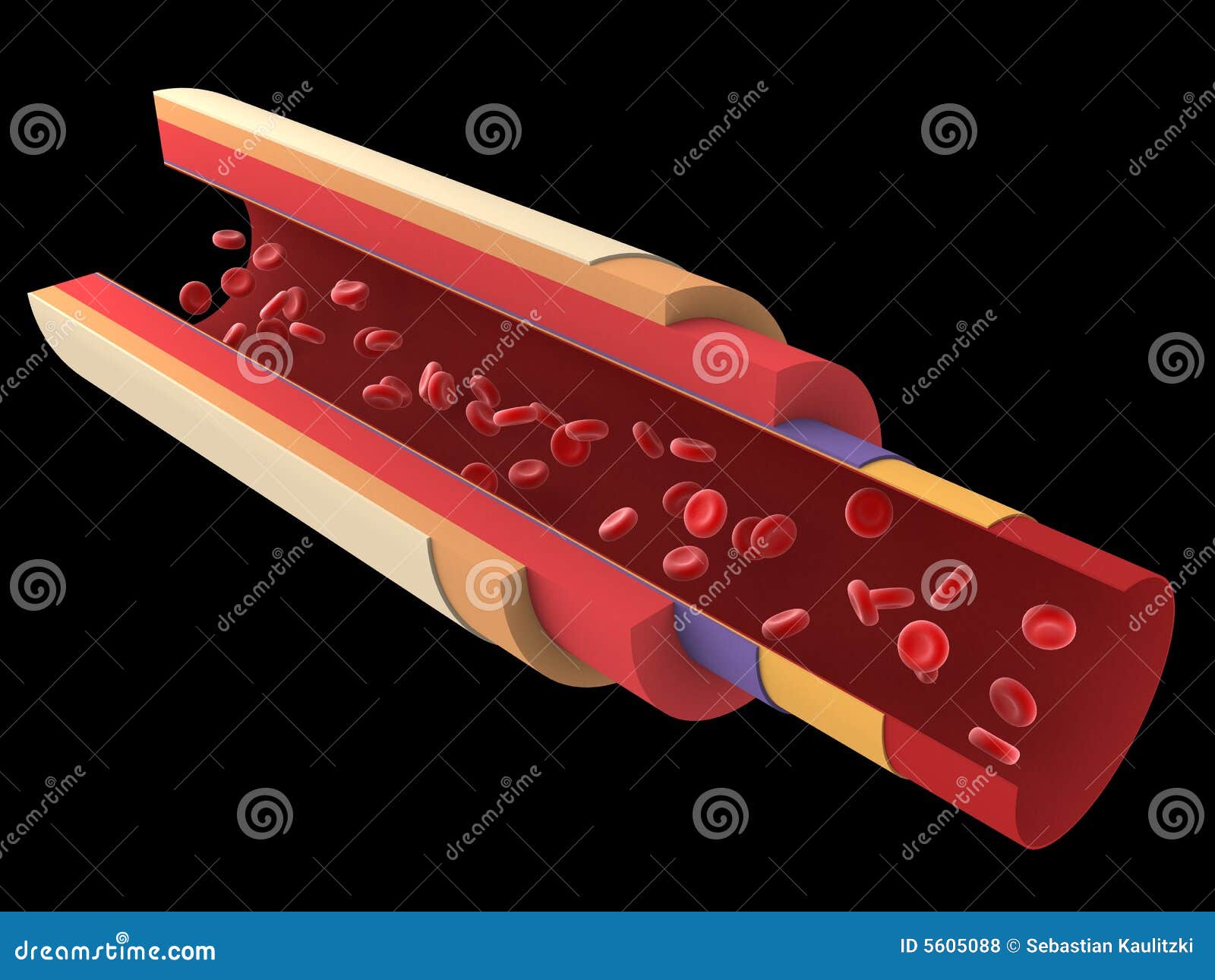 De Besnoeiing Van De Slagader Stock Illustratie - Illustration of ...