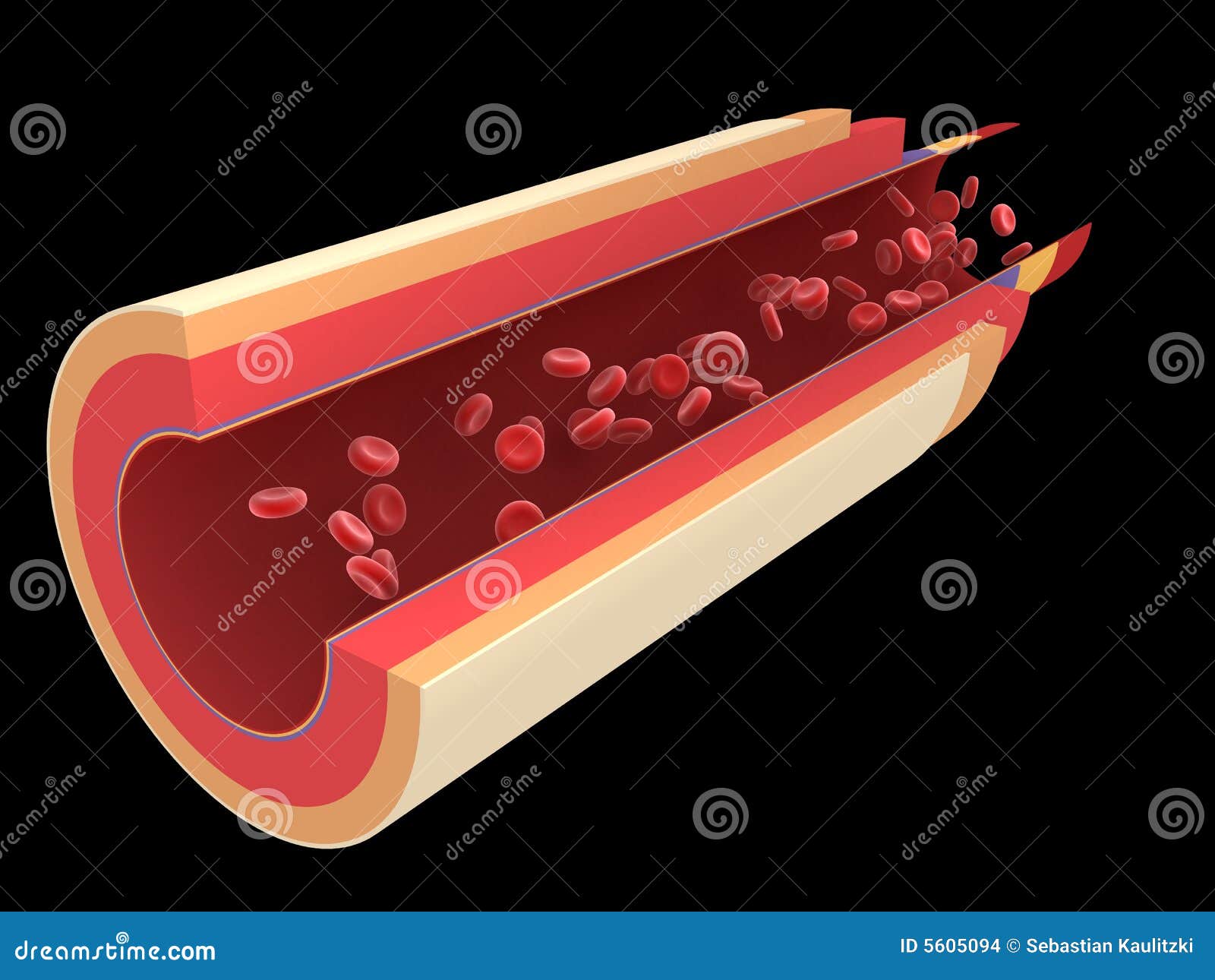 De Besnoeiing Van De Slagader Stock Illustratie - Illustration of ...