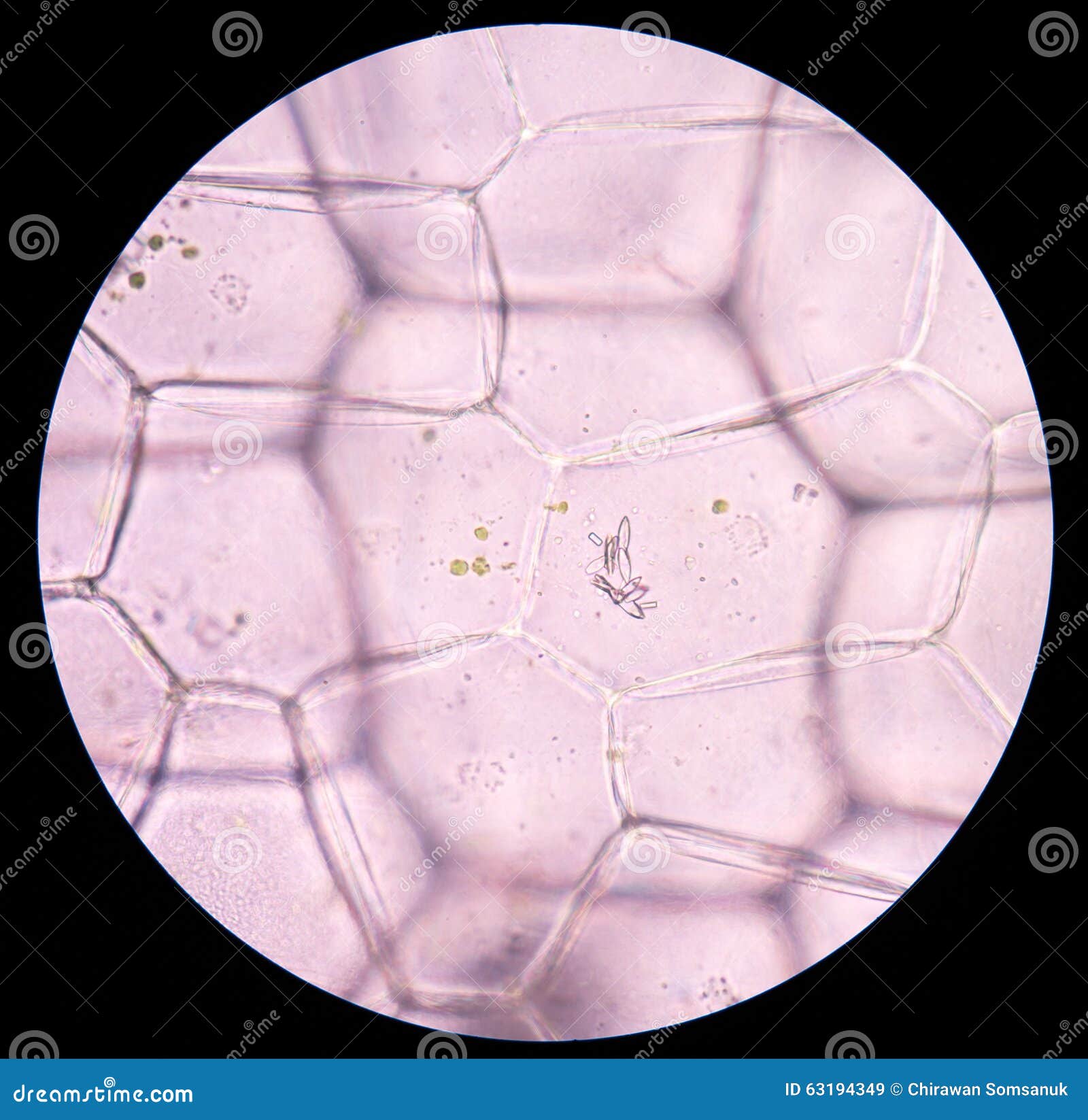 De Cellen Van De Installatie Onder Microscoop Stock Afbeelding - Image ...