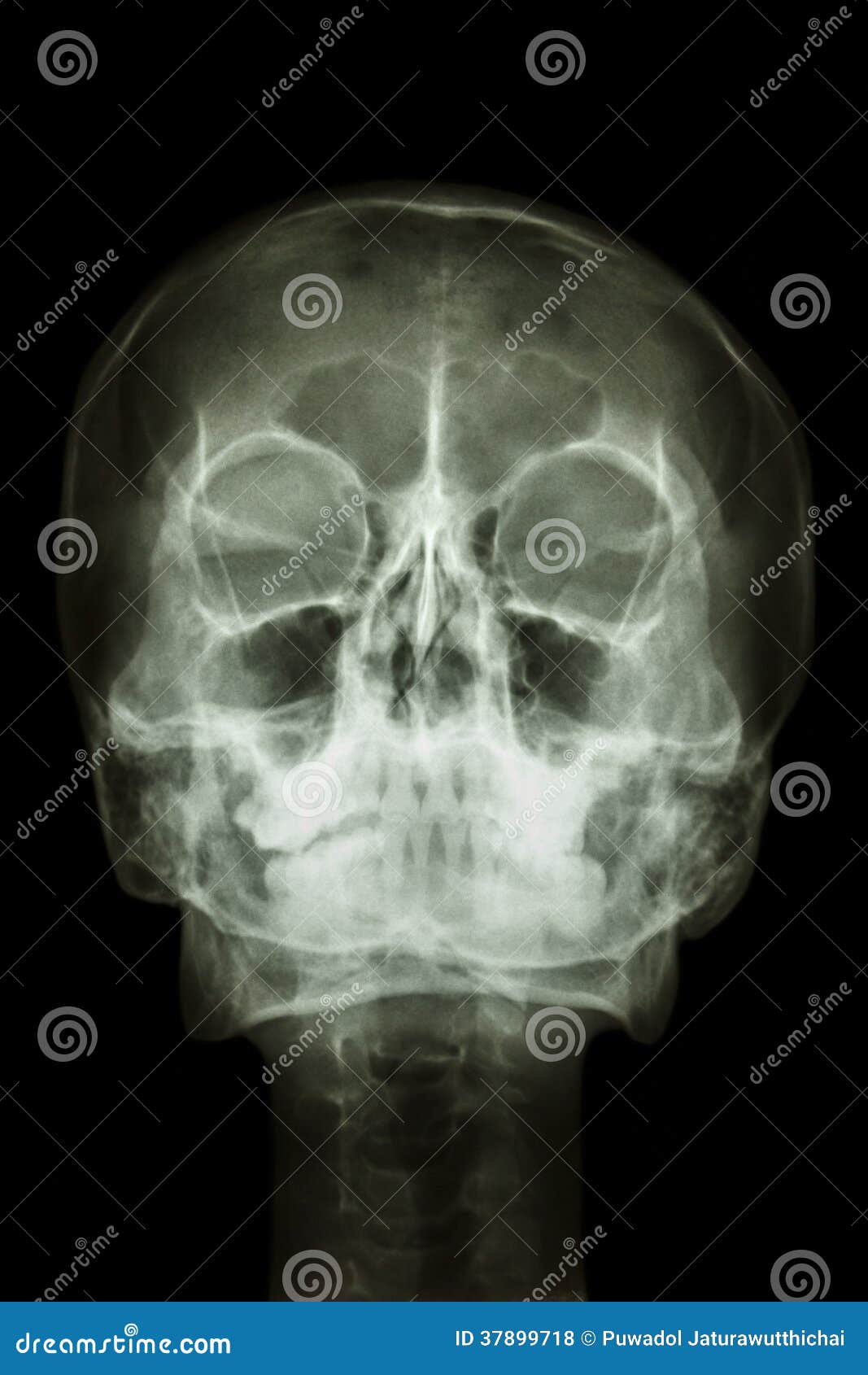 De Cervicale Stekel Van De Normale Mens De Schedel En Stock Foto ...