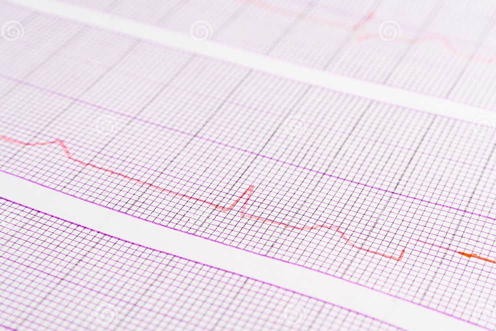 De Close-up Van Het Elektrocardiogram Stock Afbeelding - Image of ...