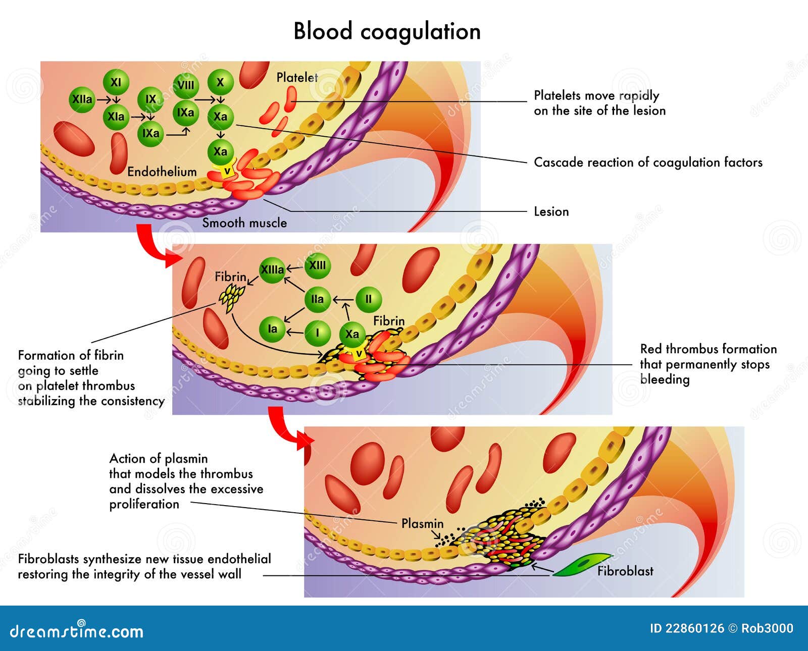 Bloedweefsel Nursing Challenge: Verpleegkundige Zorg Na Een