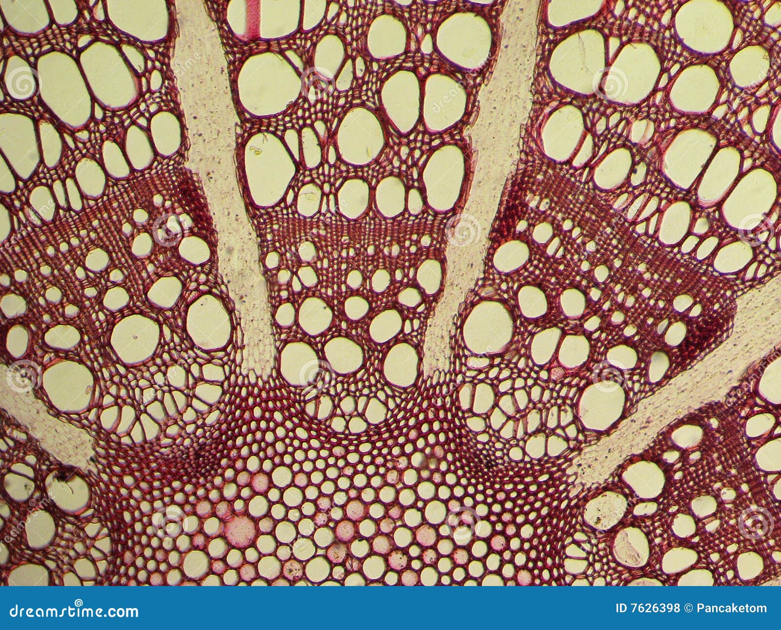 De Dwarsdoorsnede Van De Stam Stock Foto - Image of microscopisch, stam ...