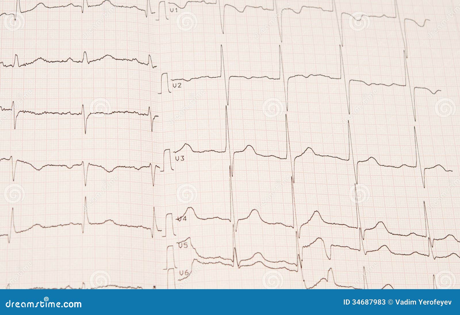 De Grafiek Van Het Hartritme Stock Afbeelding - Image of ...