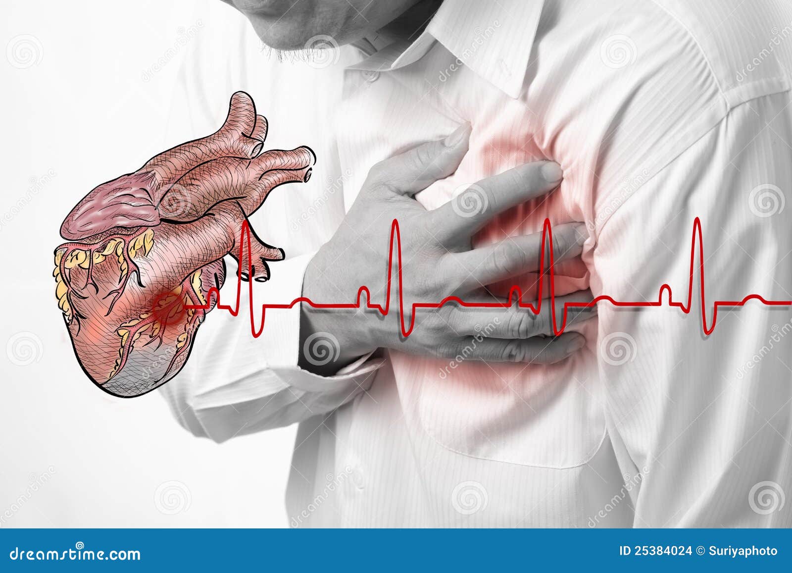 De Hartaanval En Het Hart Slaan Cardiogram Stock Foto - Image of borst ...